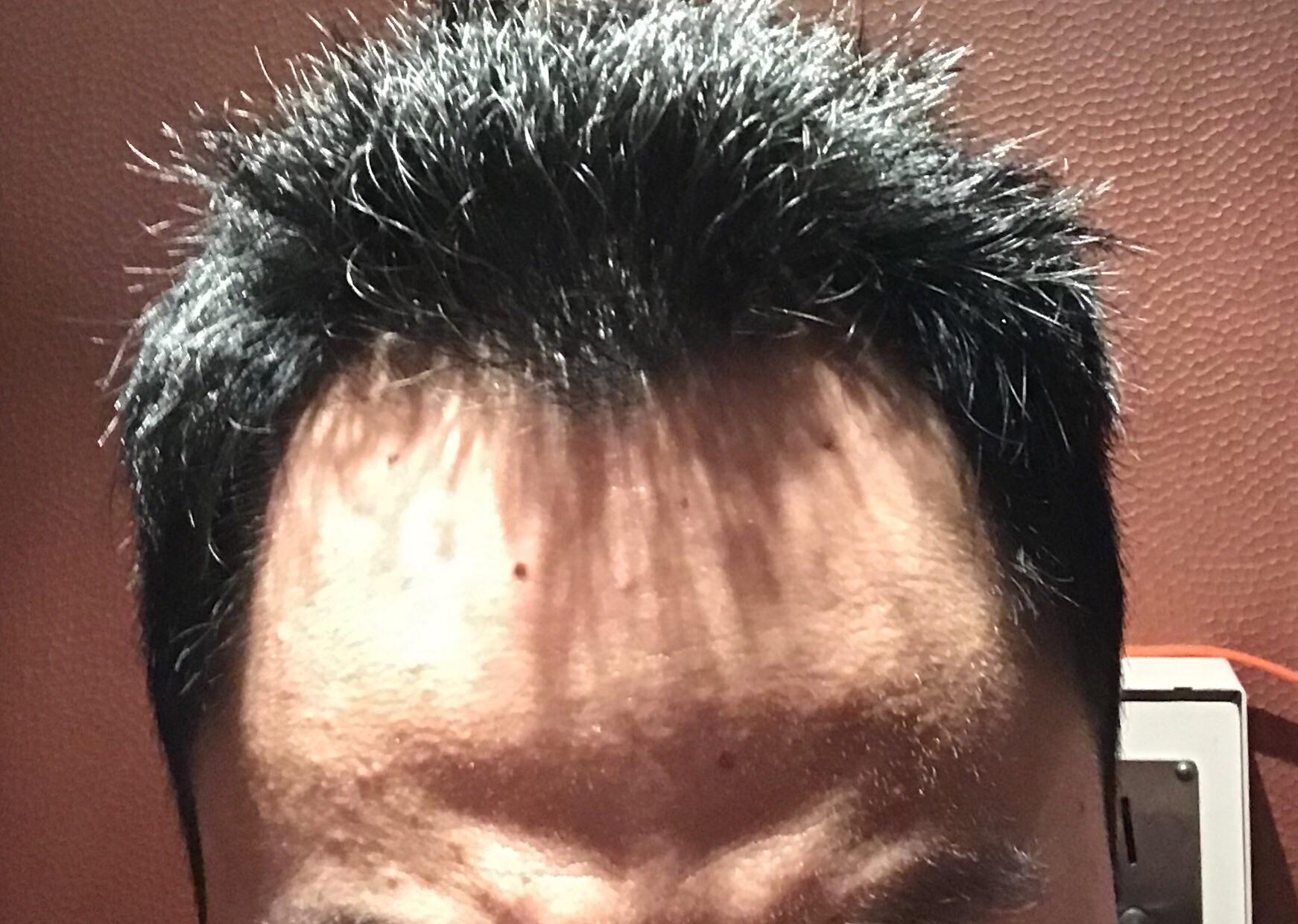 What hairstyle suits my high/ protruding forehead? | Scrolller