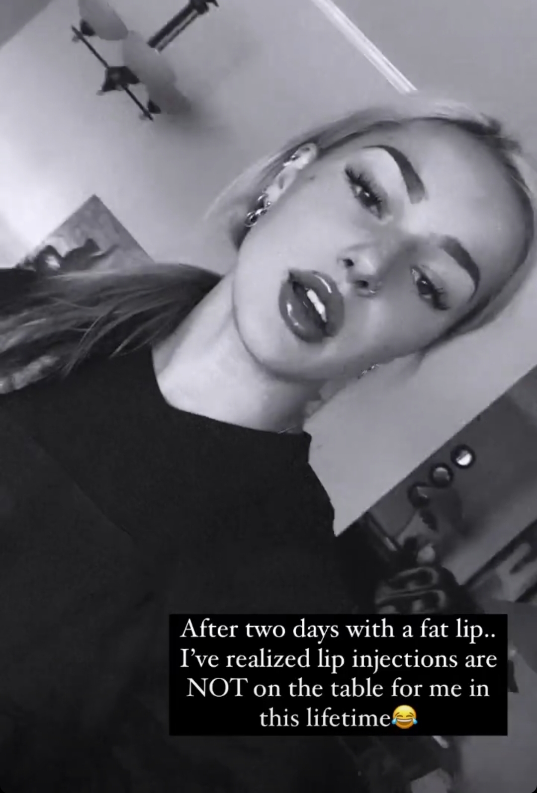 What happened to her lip exactly? injections? | Scrolller