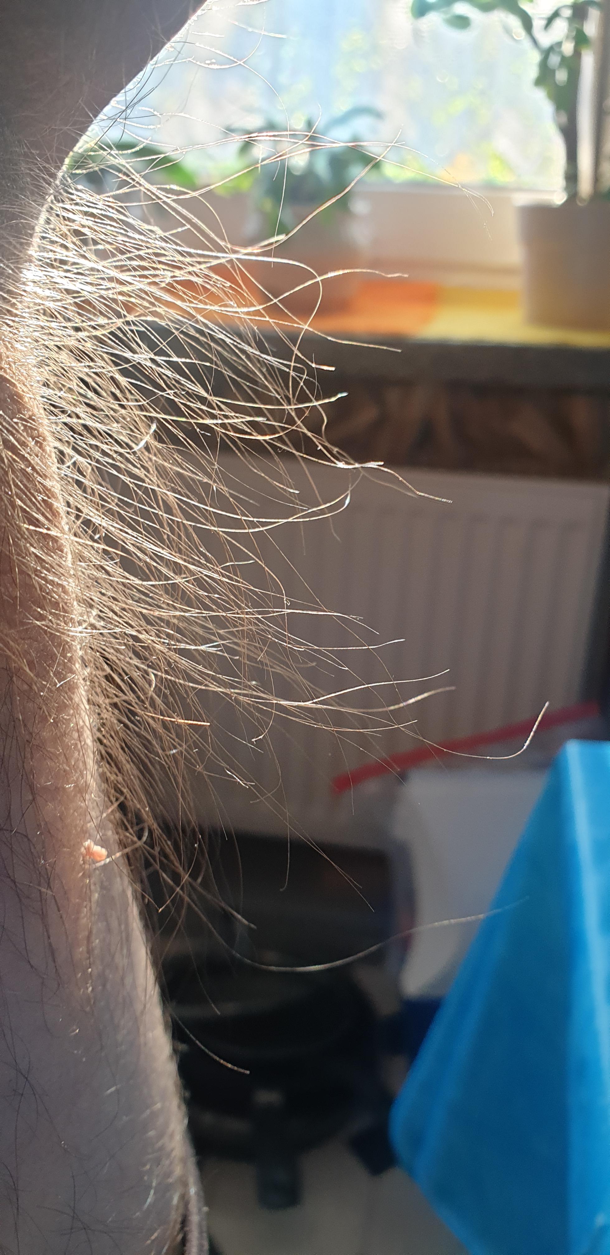 Who shows me his armpit hair? | Scrolller