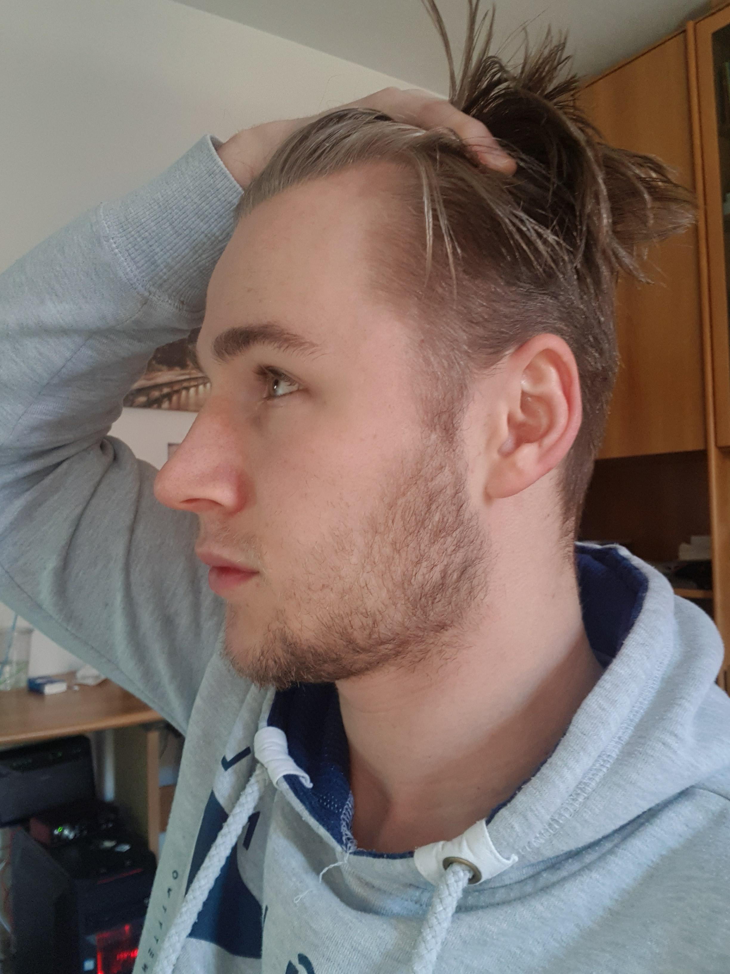 Would a buzzcut suit me? Big forehead | Scrolller