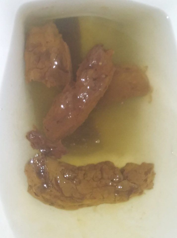 yesterdays work poop | Scrolller