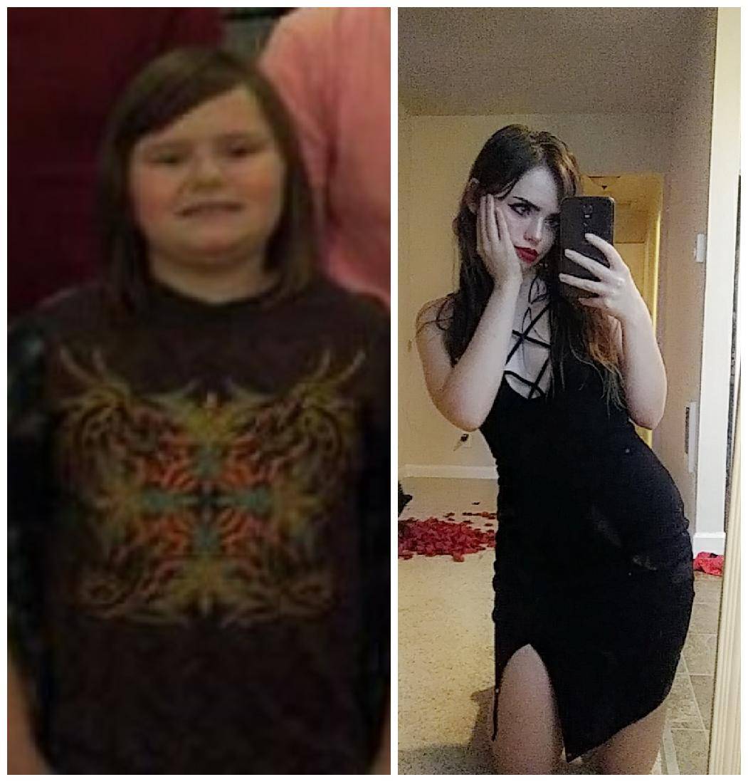 10? To 18. Same height, 35lbs less. (: | Scrolller