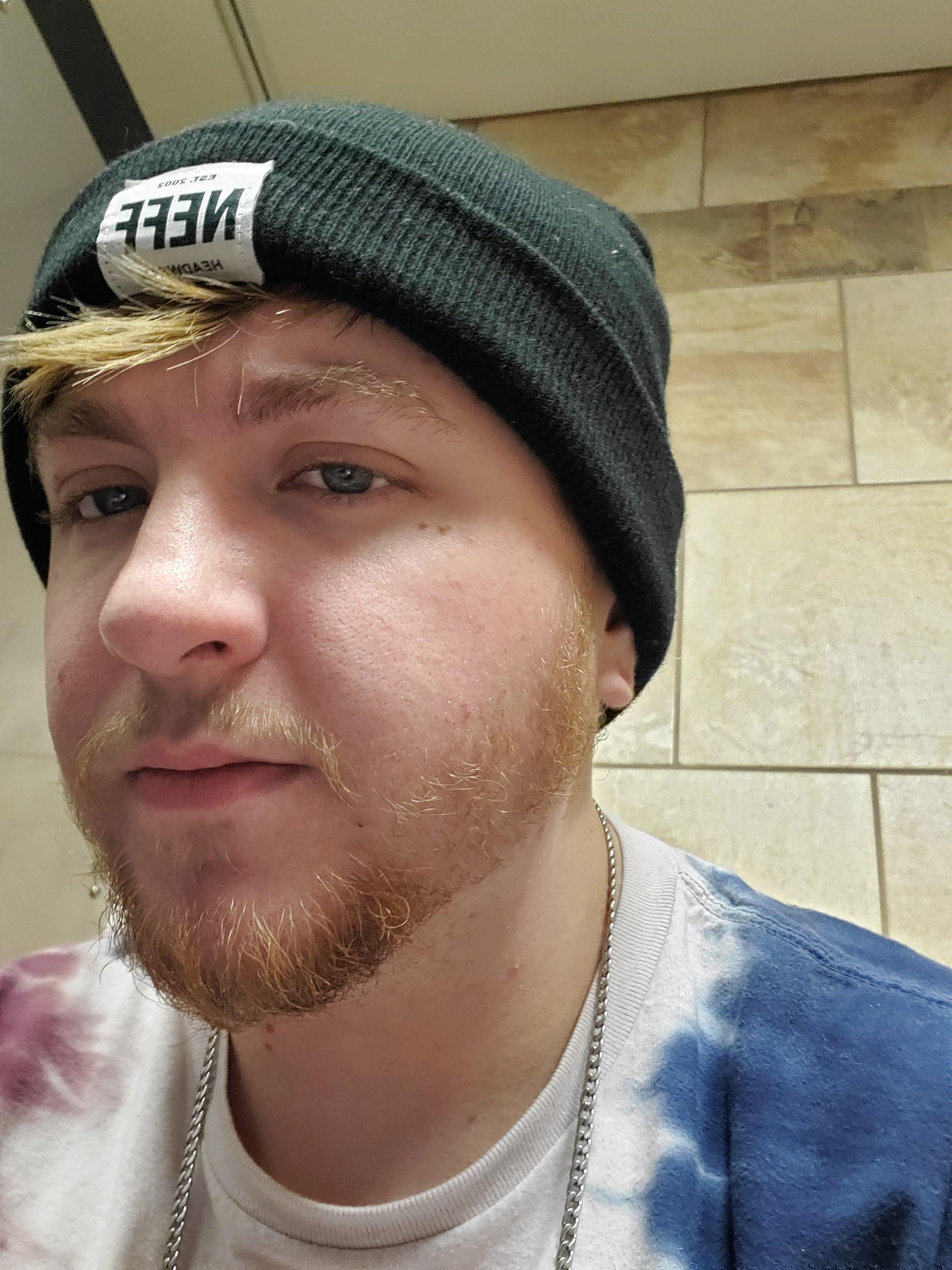 21, 3.5 years on T. My mustache finally appeared | Scrolller