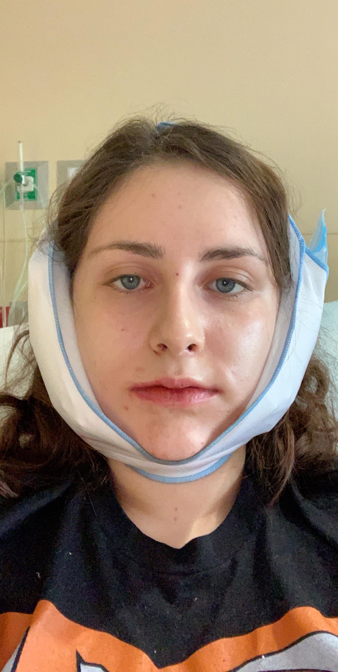 24 hours after DJS!! | Scrolller