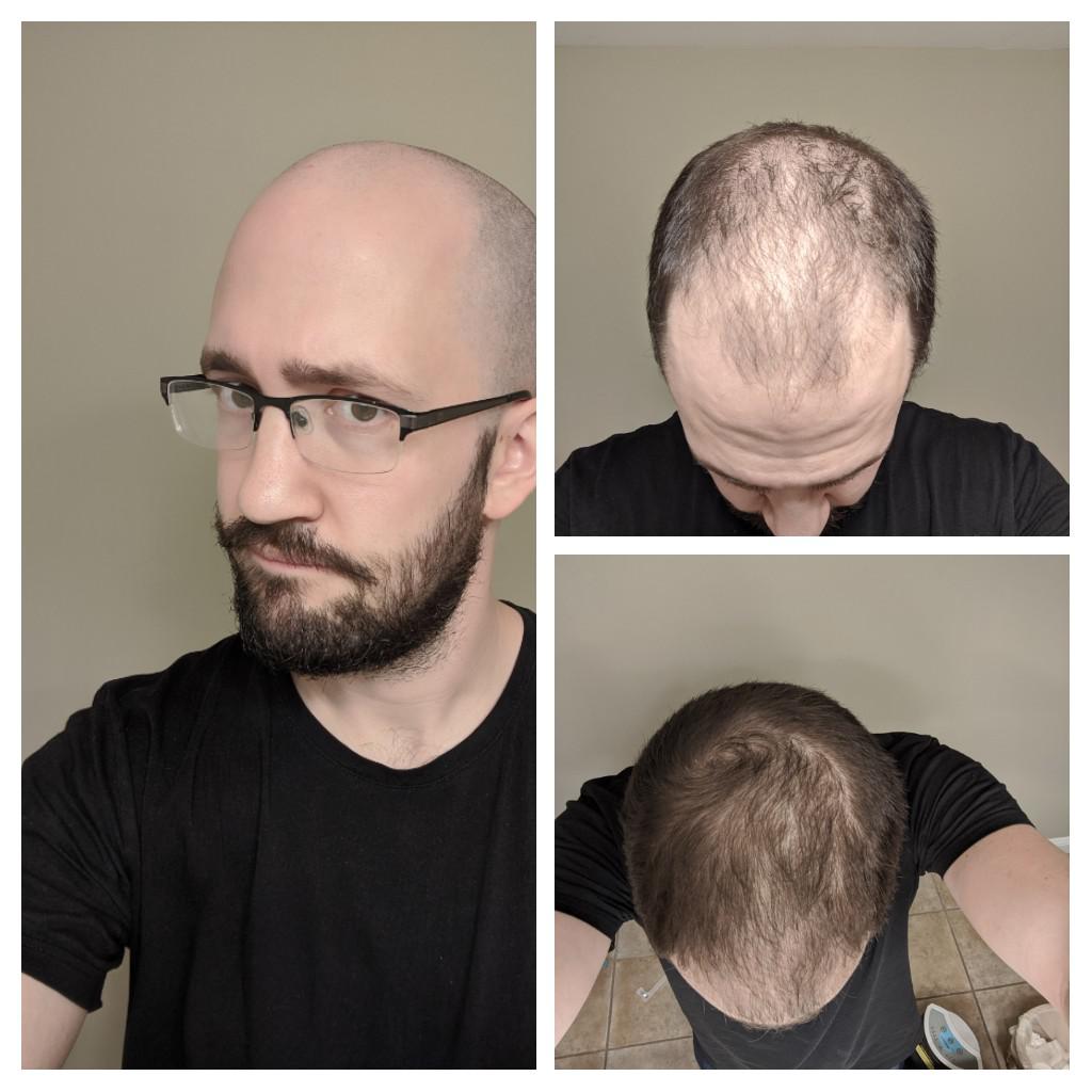 30, and shaved my head Friday for the first time. Feeling great! | Scrolller