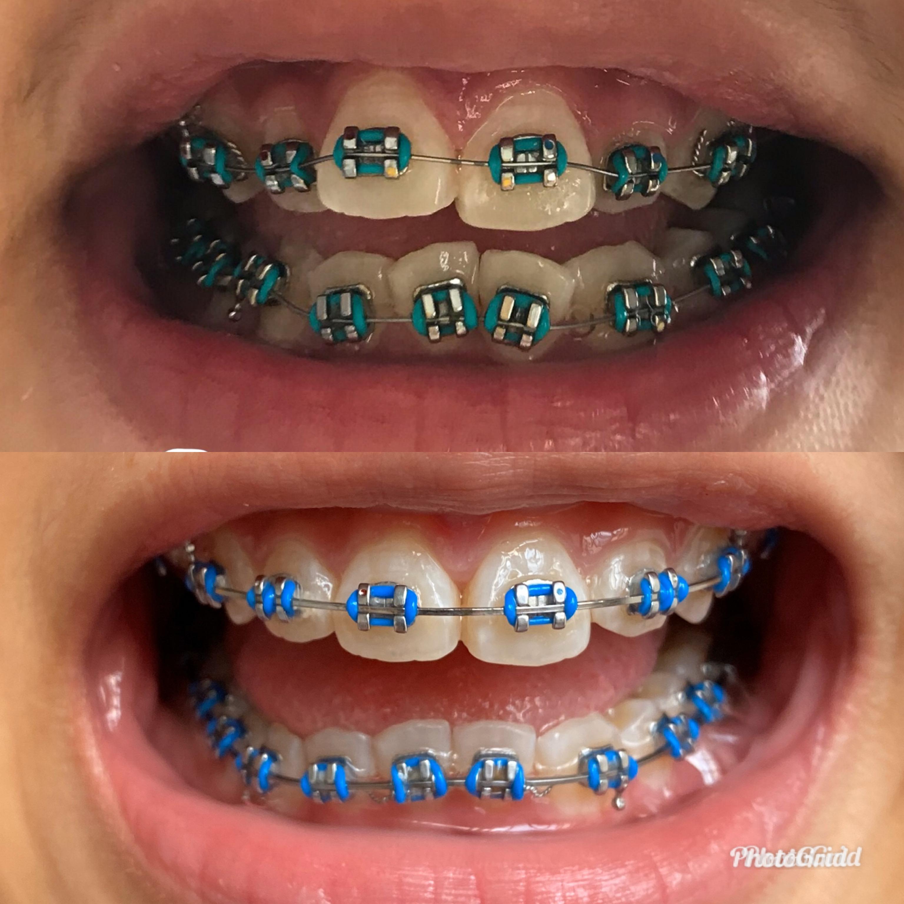 4 months progress! | Scrolller