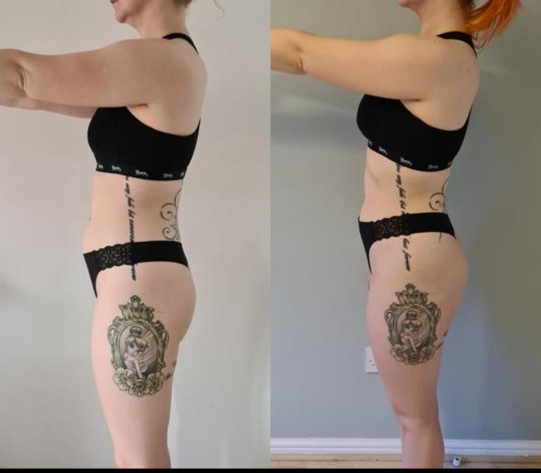 5 months in, +1000cal a day! Slow and steady progress, but progress is progress! | Scrolller