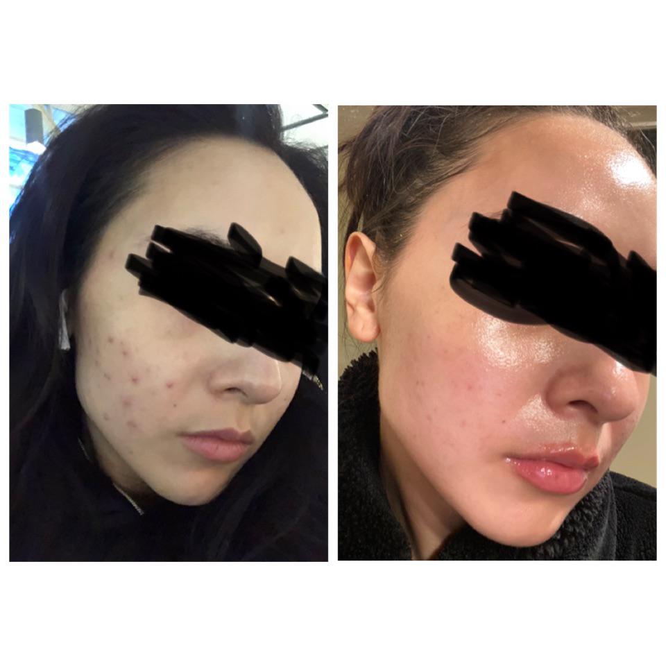 7 months | Scrolller