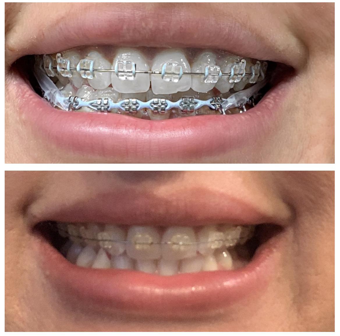 7 months | Scrolller