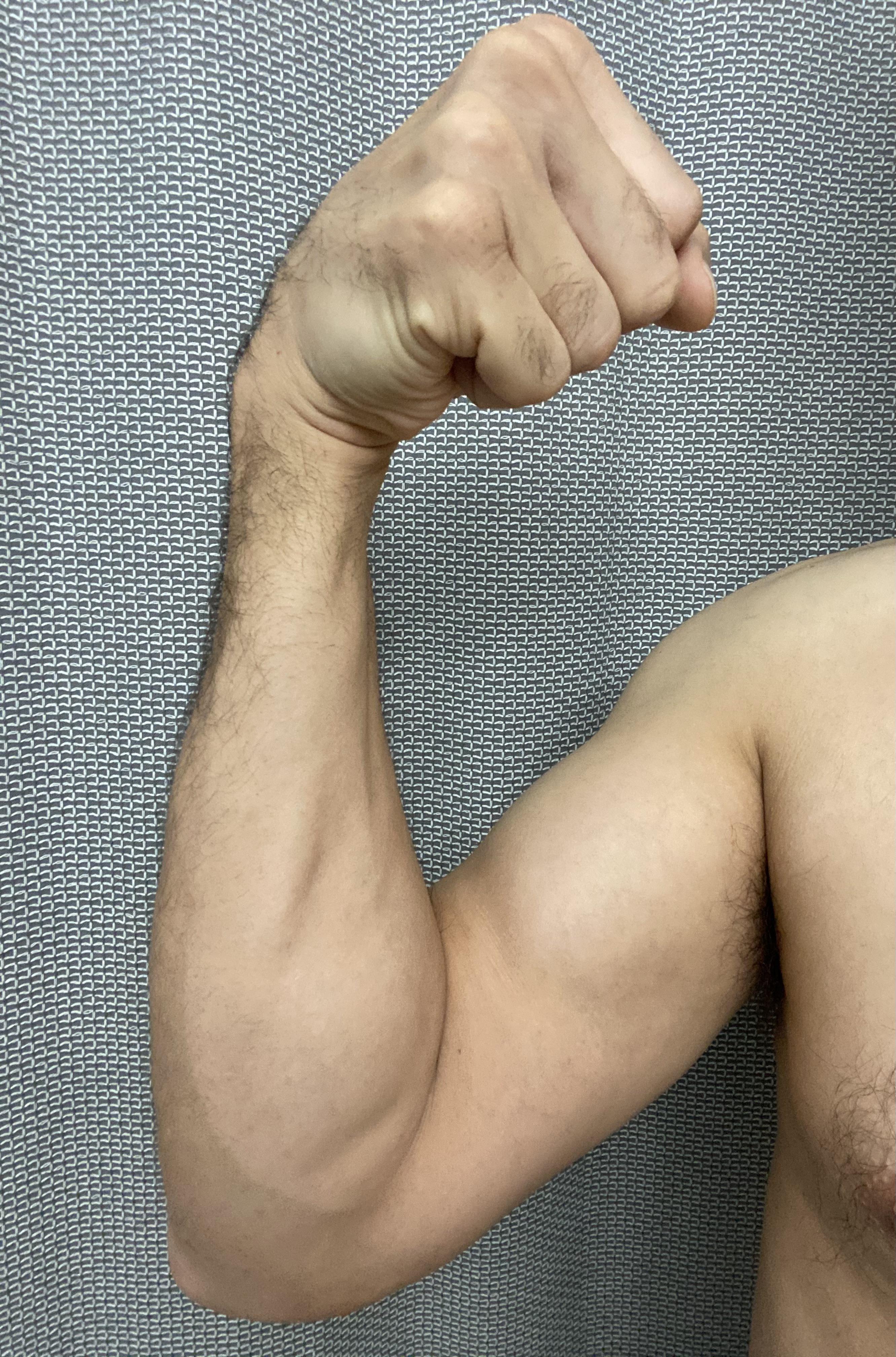 A little forearm | Scrolller