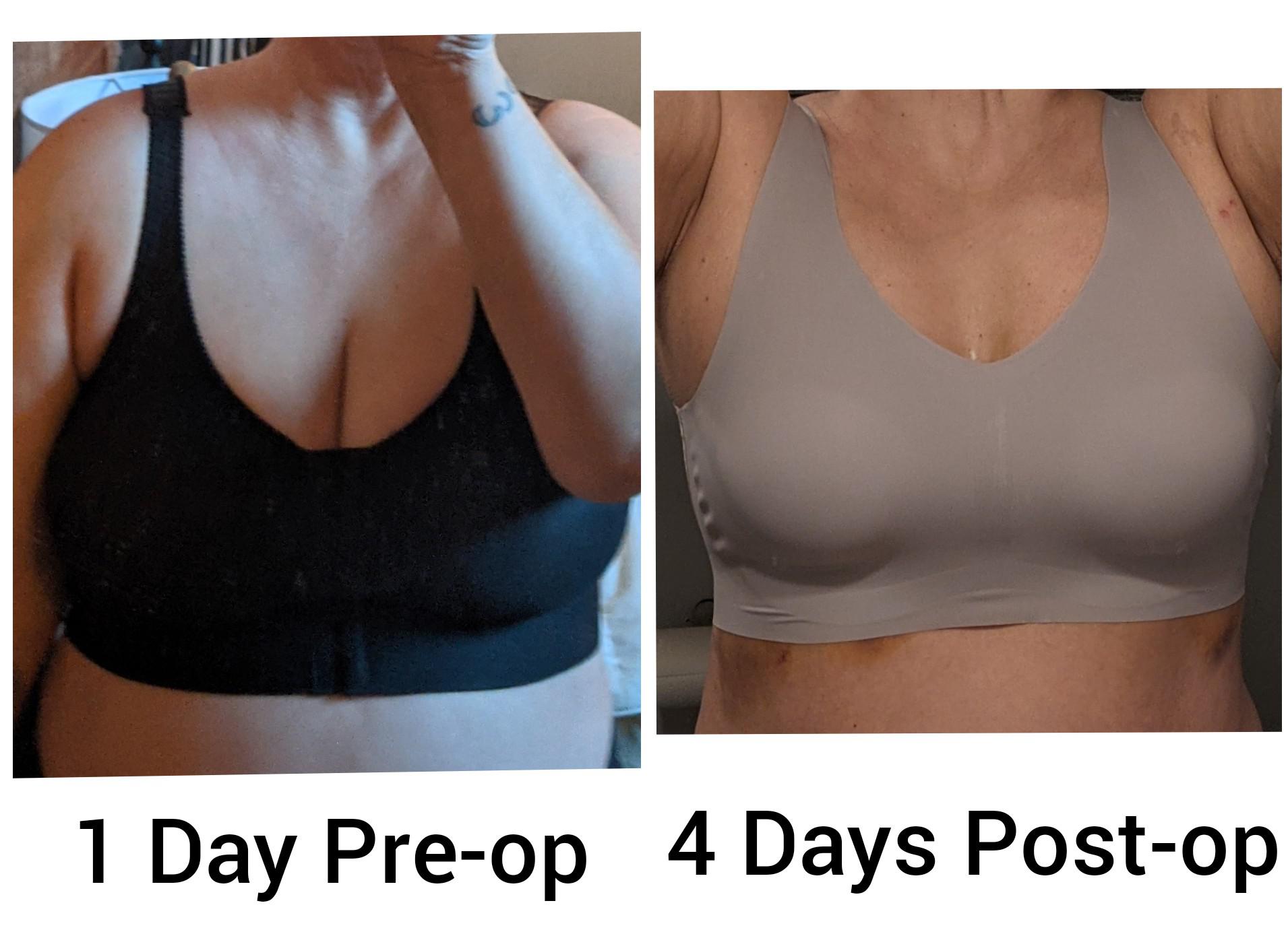 A reduction is so much more | Scrolller