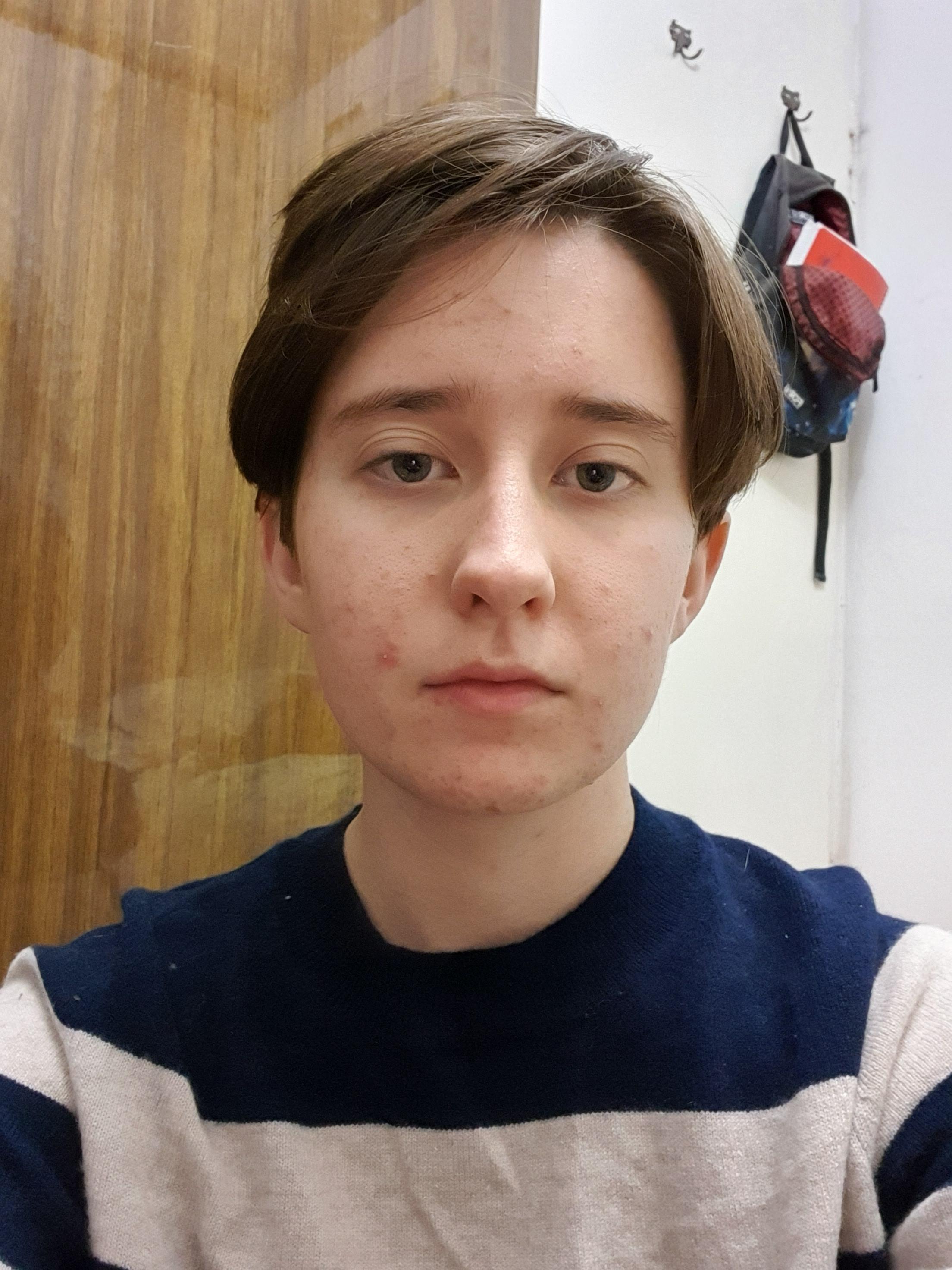 Age/gender? | Scrolller