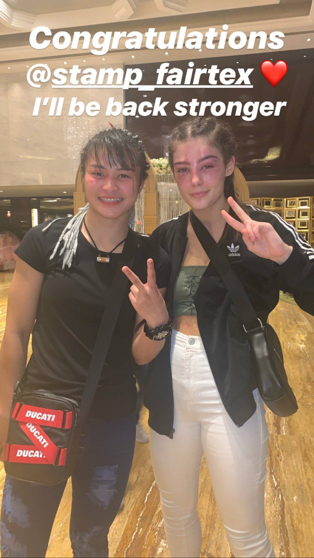 Alma Juniku - "Congratulations @stamp_fairtex I'll be back stronger" | Scrolller