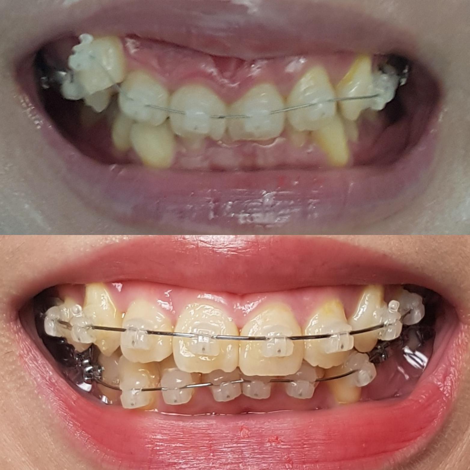 Almost 7 months progress | Scrolller