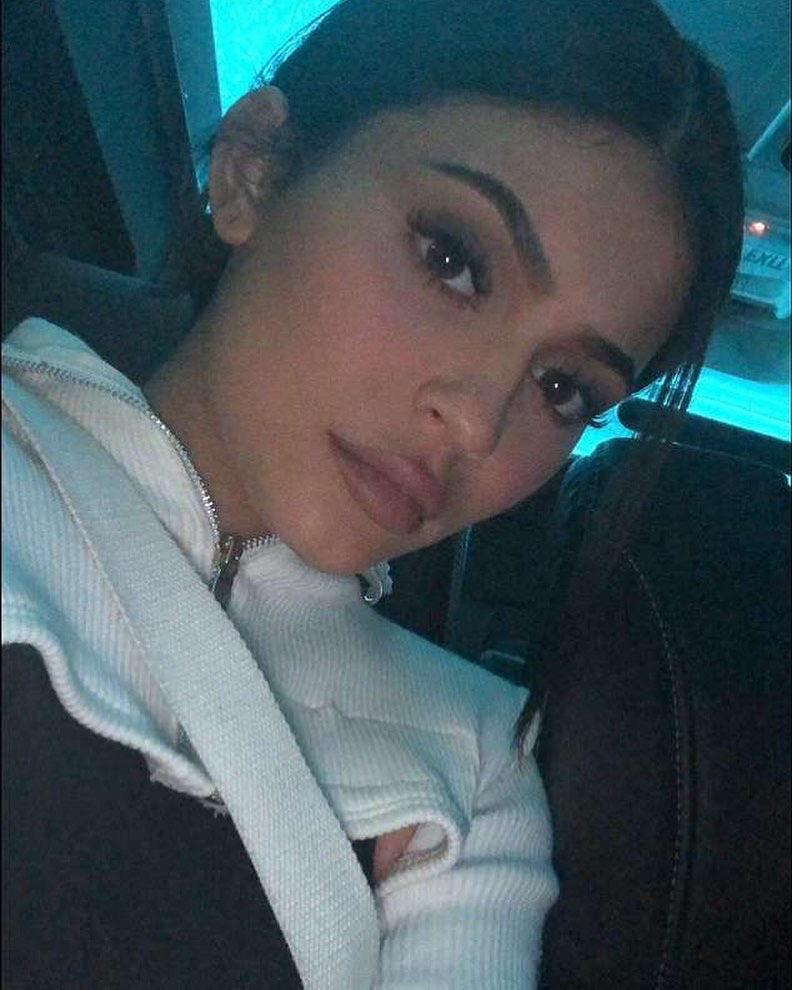 amazing lips | Scrolller