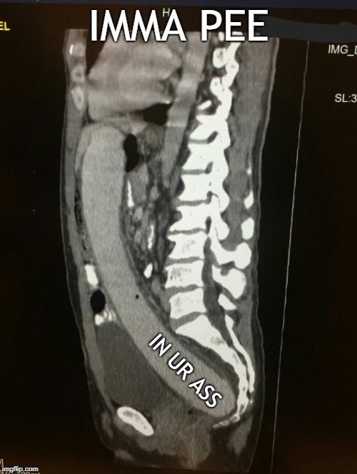 an xray of what imma do 2 u | Scrolller