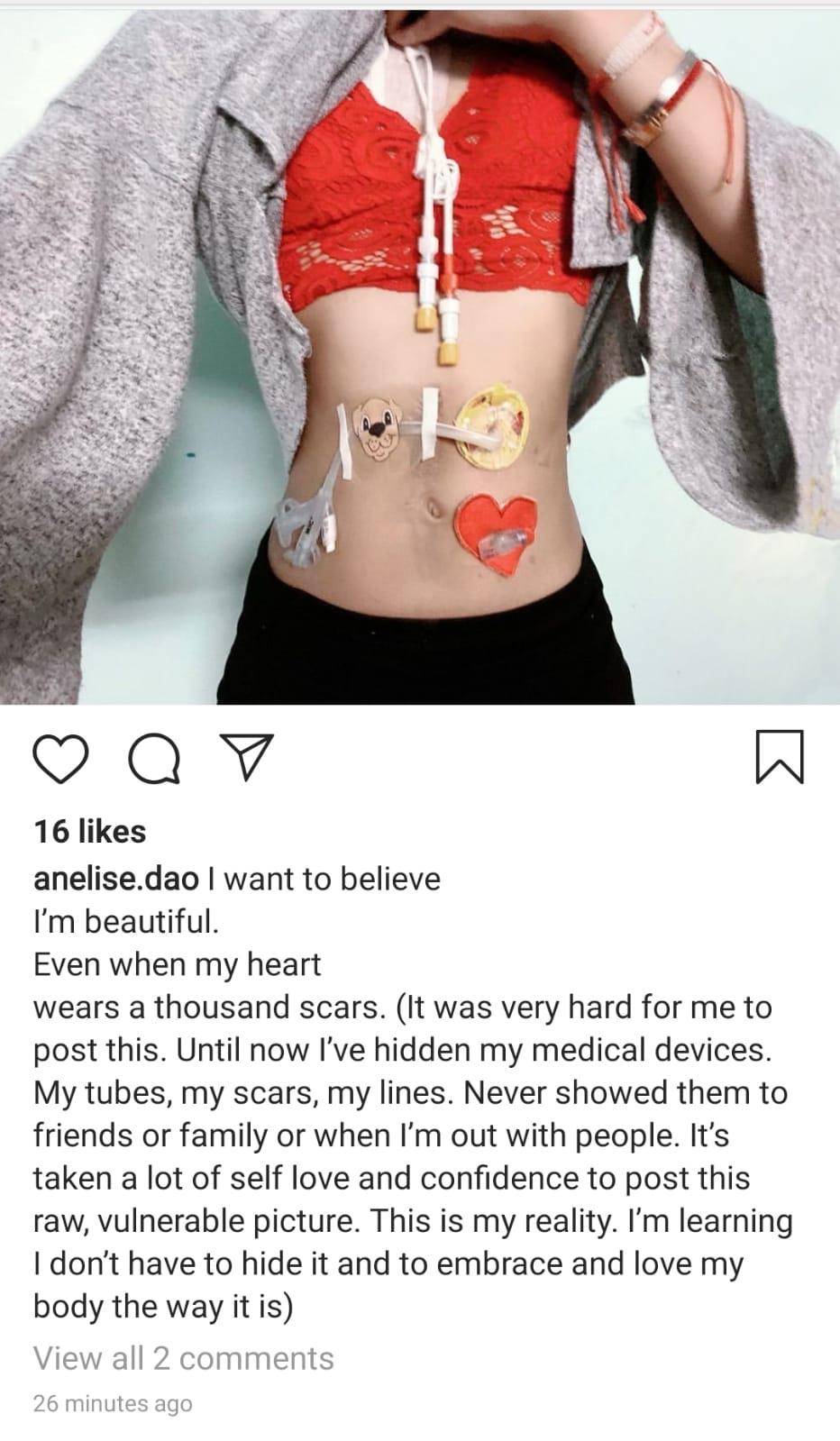 Anelise showing off her various tubes | Scrolller