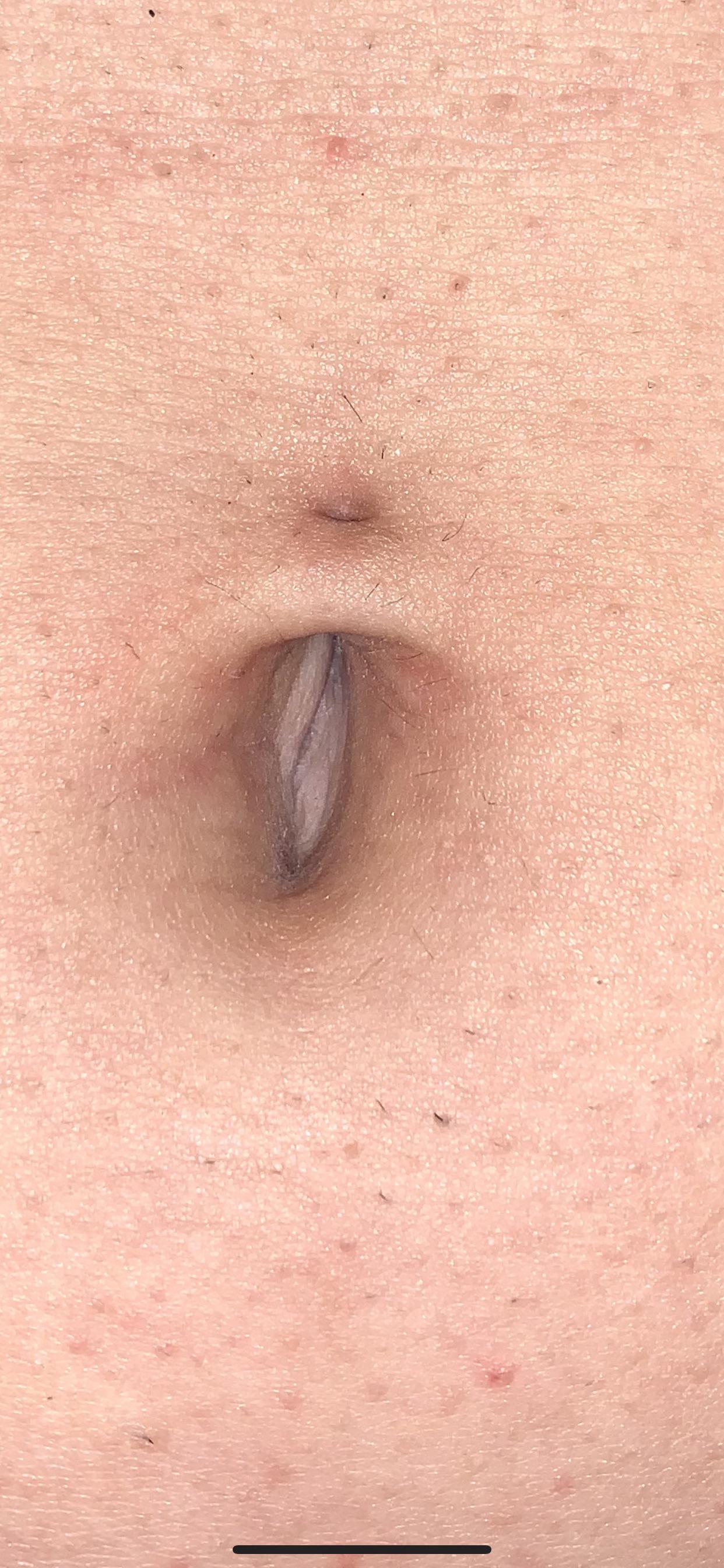 Another close up | Scrolller