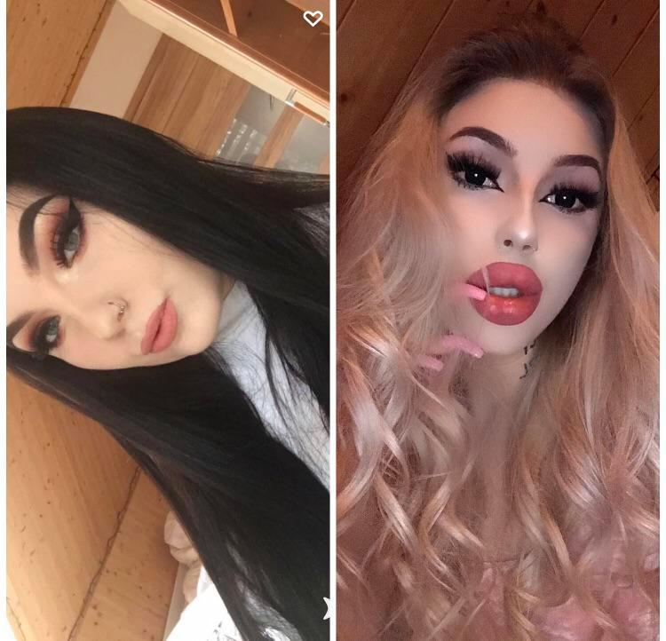 Another pic of my incredible transformation😱💉 | Scrolller