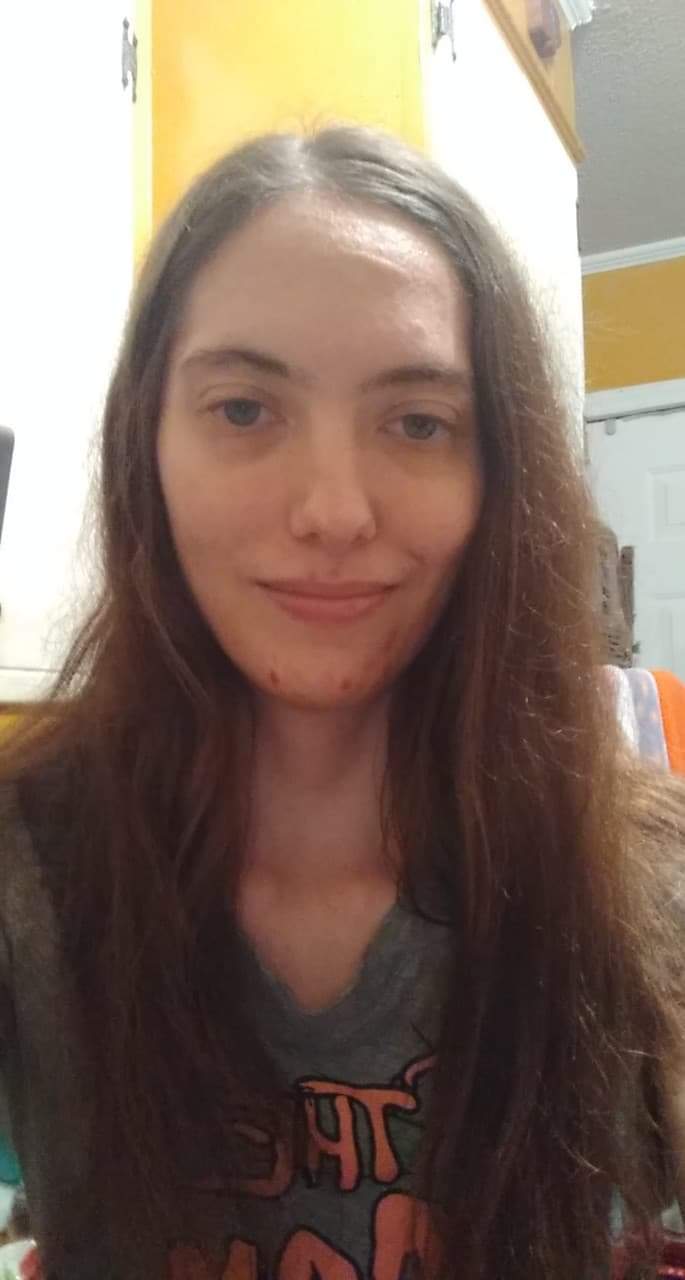 Anyone Wanna Watch Me Strip Scrolller 9444