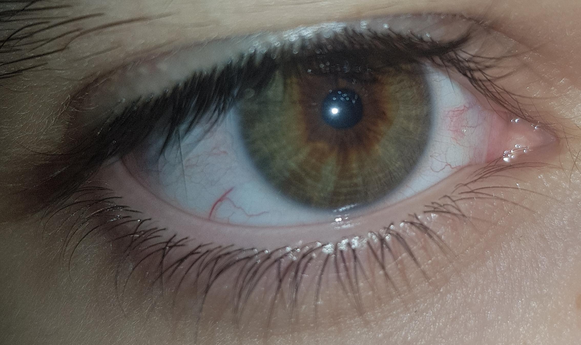 Are these central heterochromia or hazel? | Scrolller