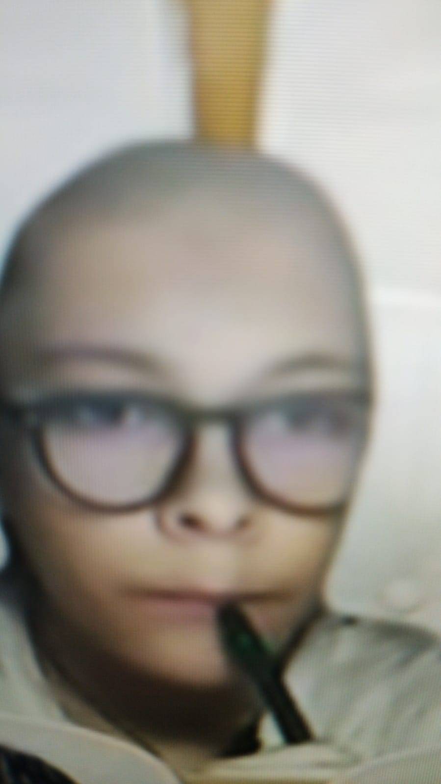 bald man. | Scrolller