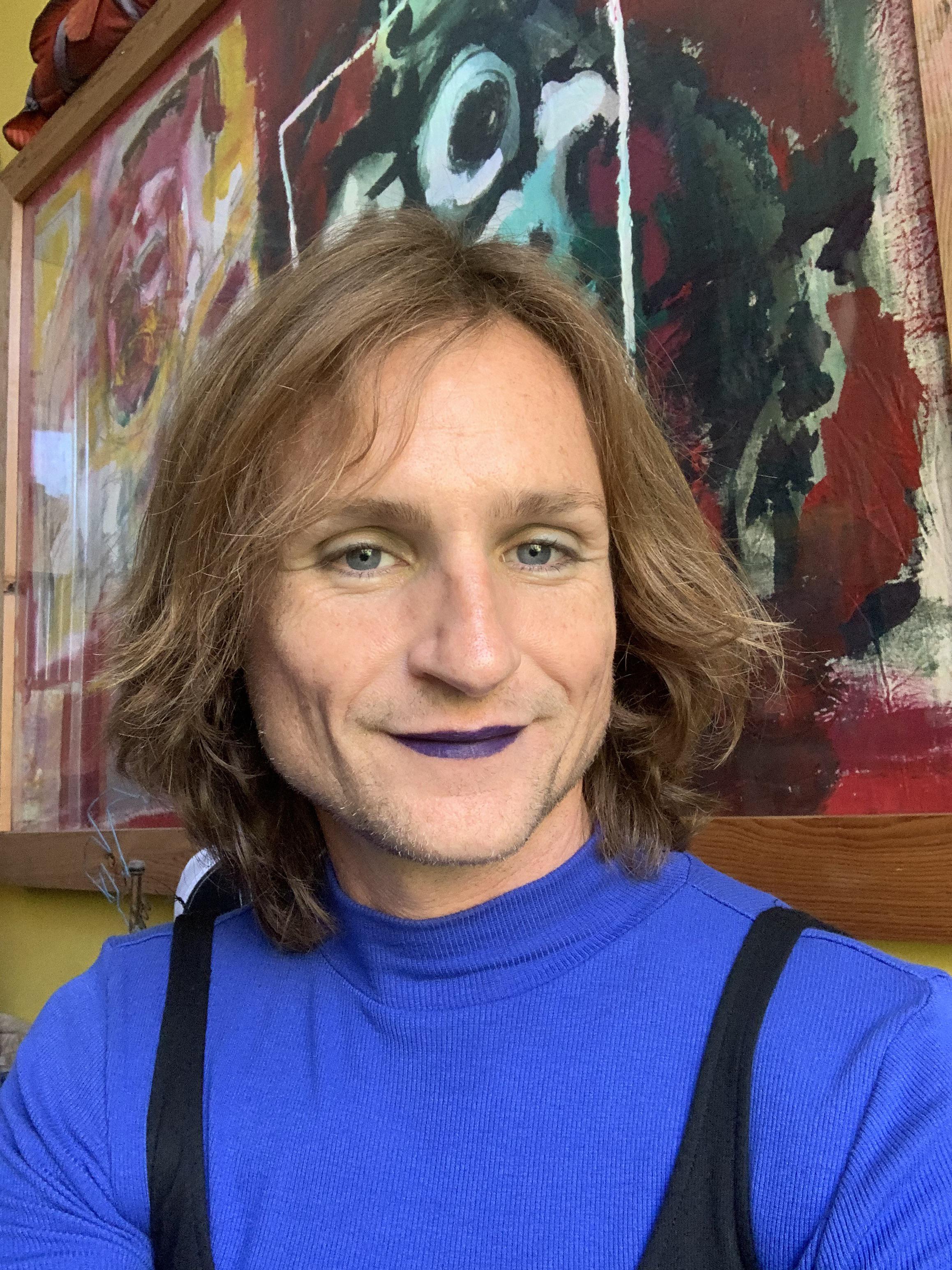 Bead head at six months hrt | Scrolller