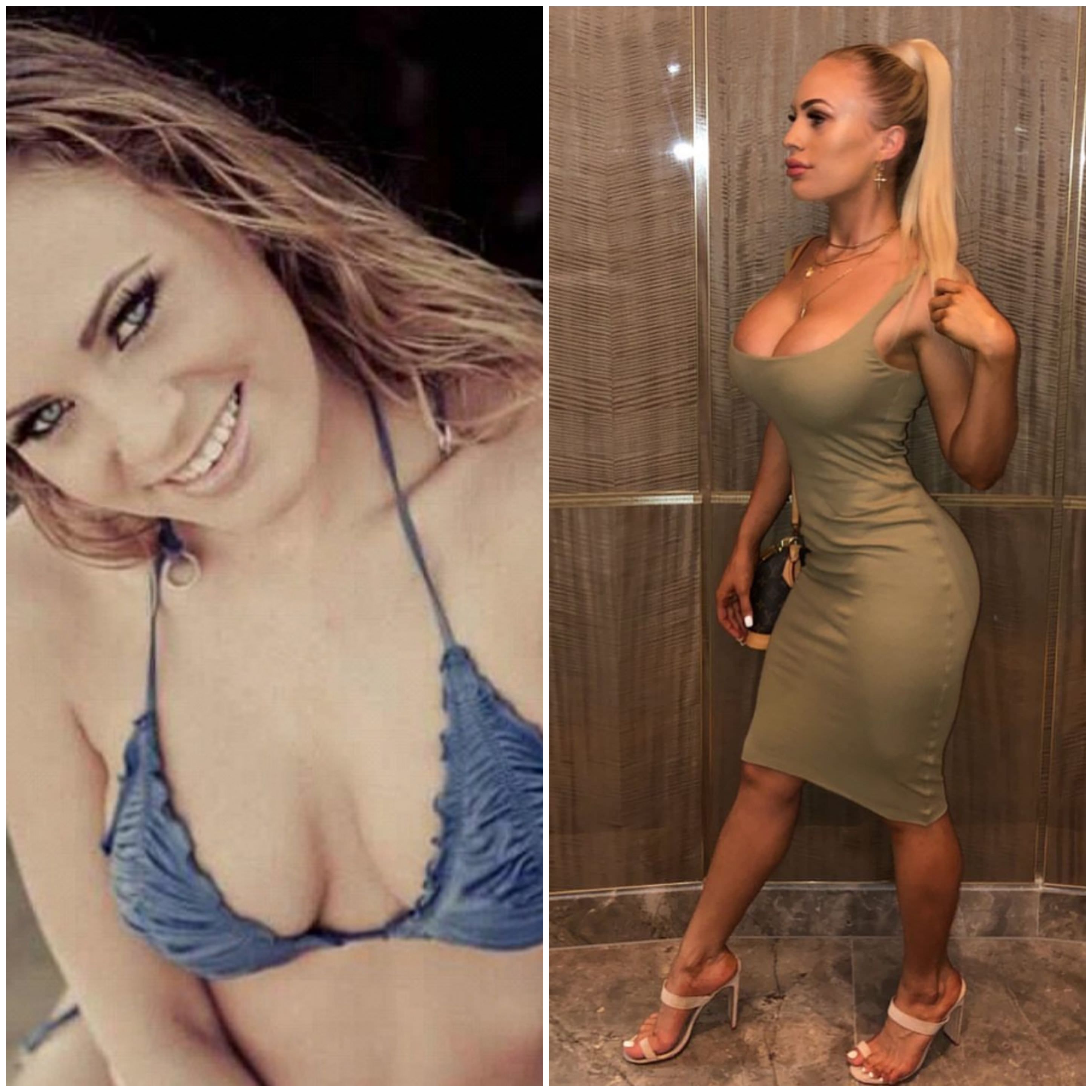 Before and after | Scrolller