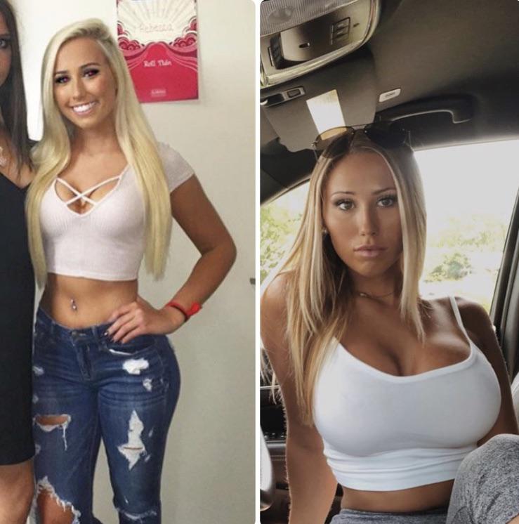 Before and after her bimbofication | Scrolller