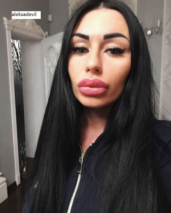 Big fake lips | Scrolller