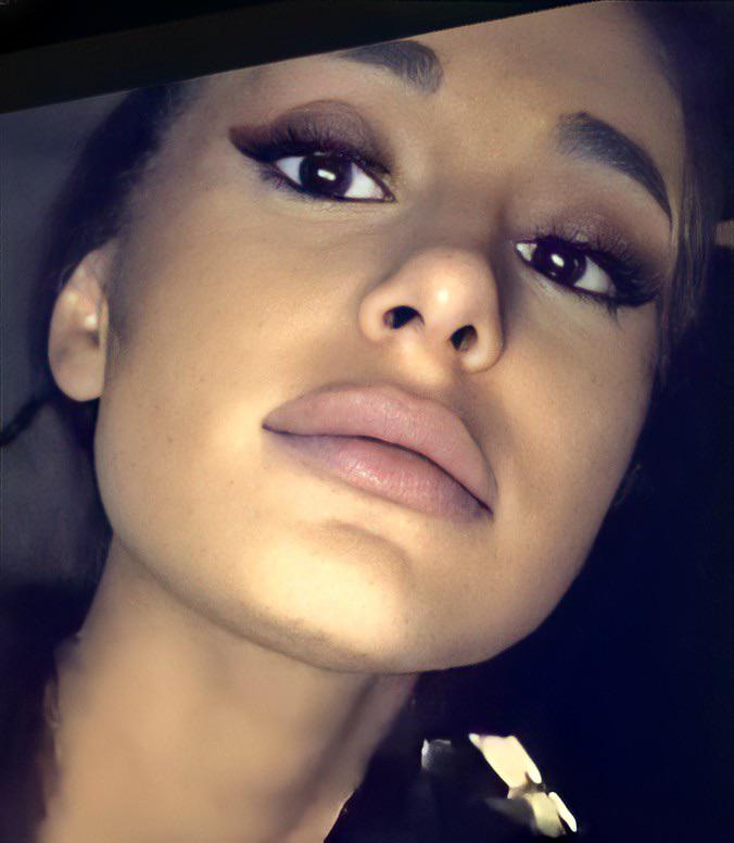 Bimbo lips at their finest | Scrolller