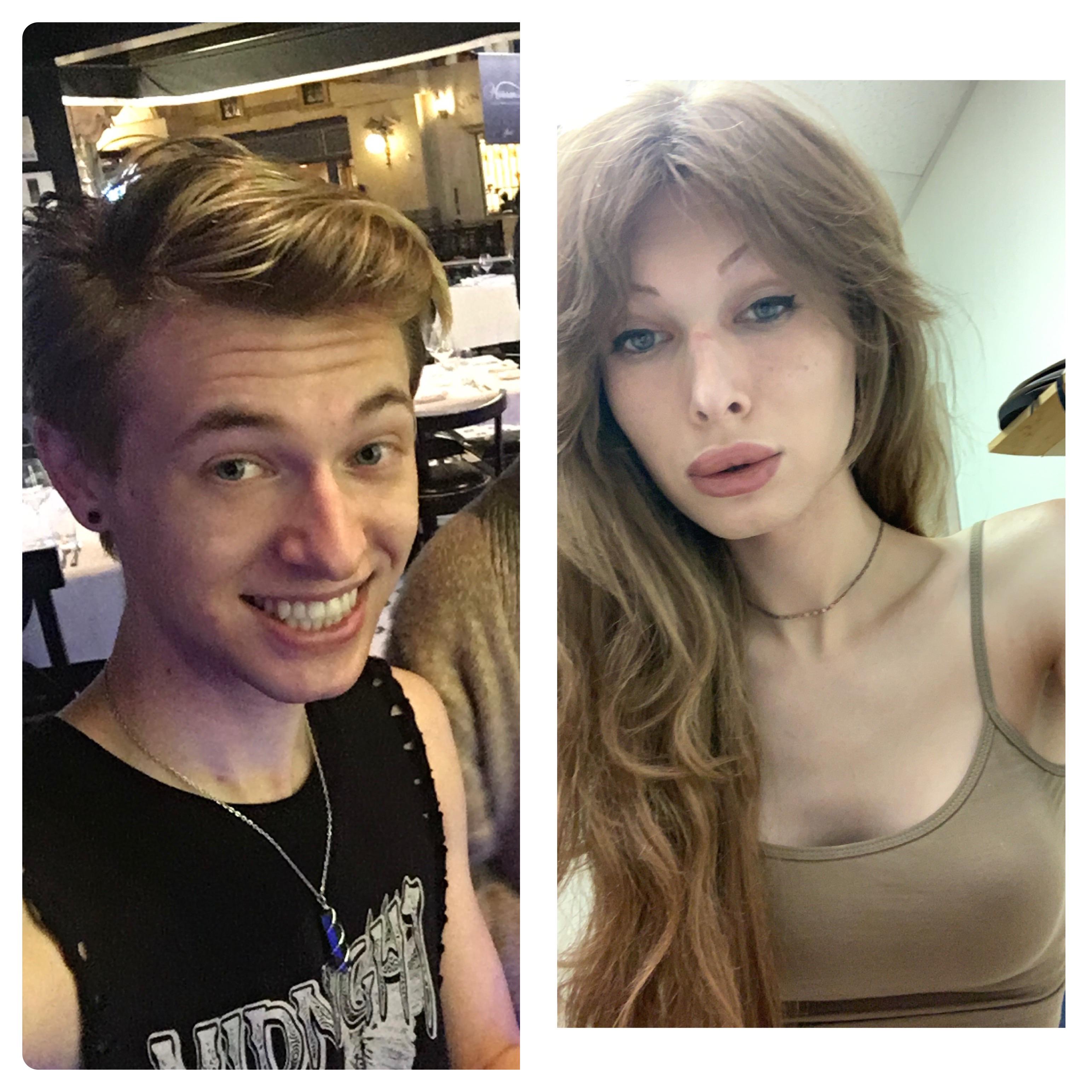 Bimbo progress! 4 years difference between photos. | Scrolller