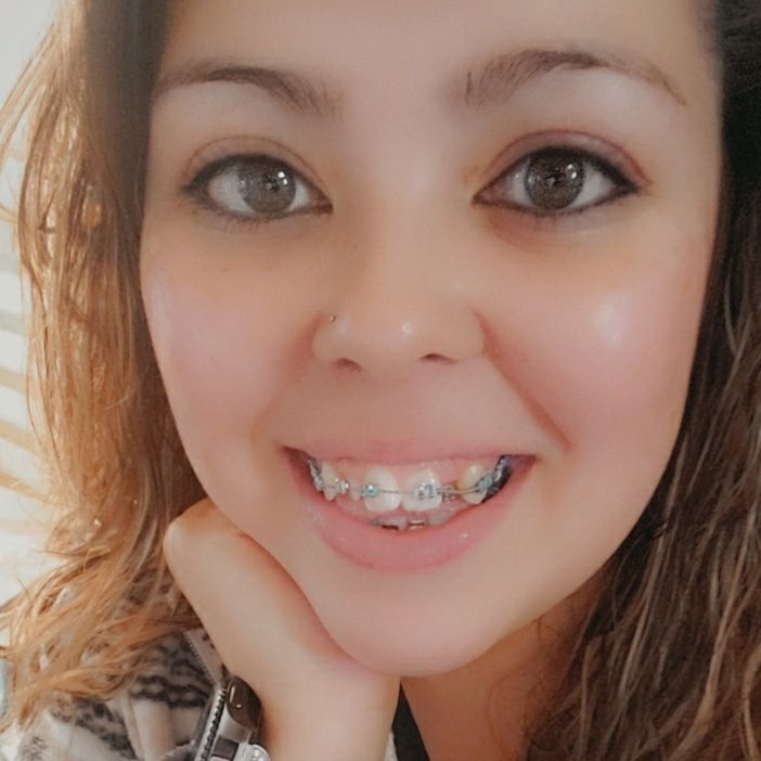 Braces for my 26th Birthday!!!! | Scrolller