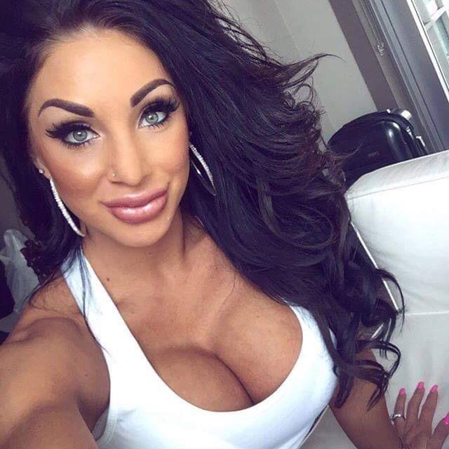 Brunette Bimbo with lip fillers | Scrolller