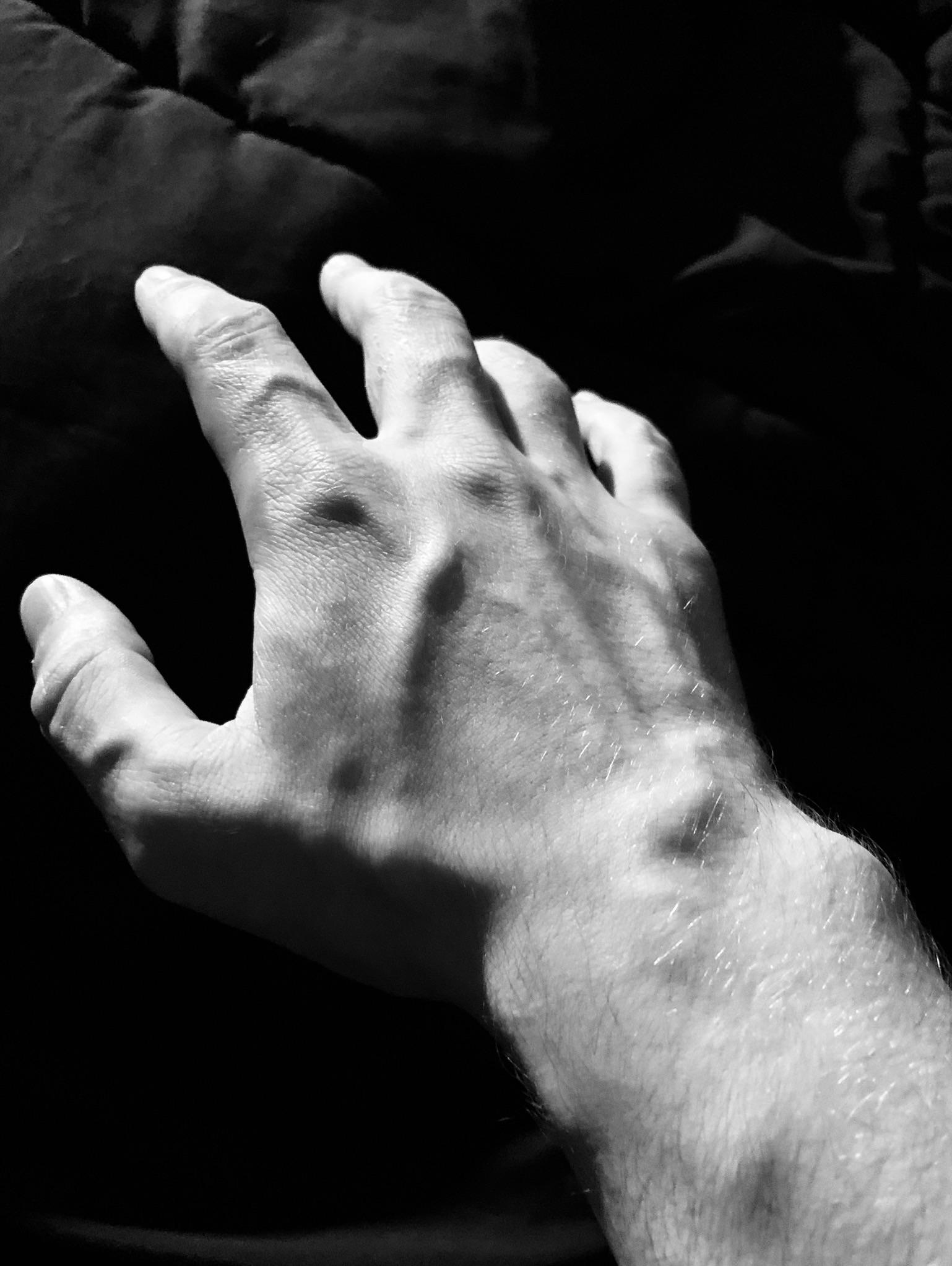 Bulging Veins | Scrolller