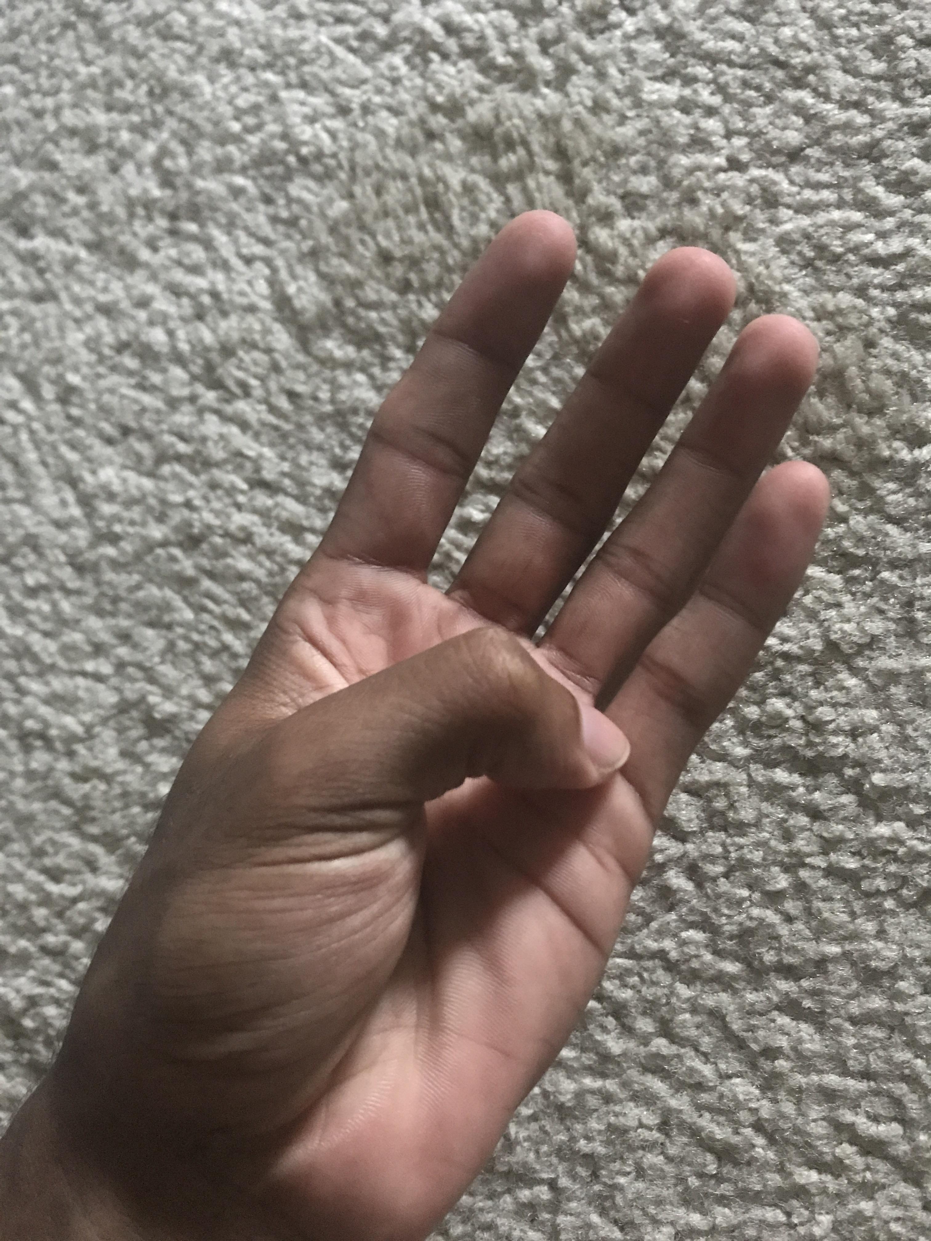 Can Anyone Explain Why My Thumb Doesn T Bend At The Base Joint I Ve