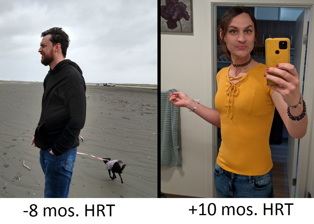 Casual Look: Then and Now. (32 MtF, 10.5 months HRT. Some laser, no surgeries.) | Scrolller