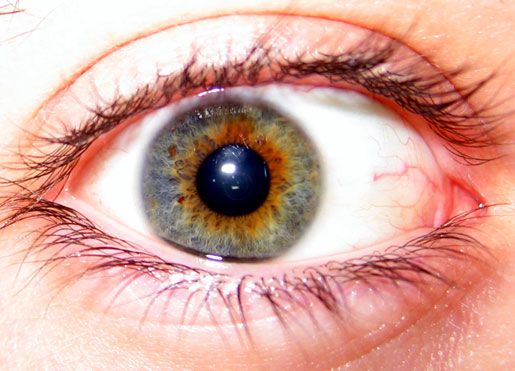 Central Heterochromia, with a few red specs | Scrolller