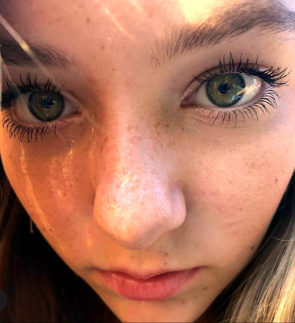 Close up beauty. | Scrolller