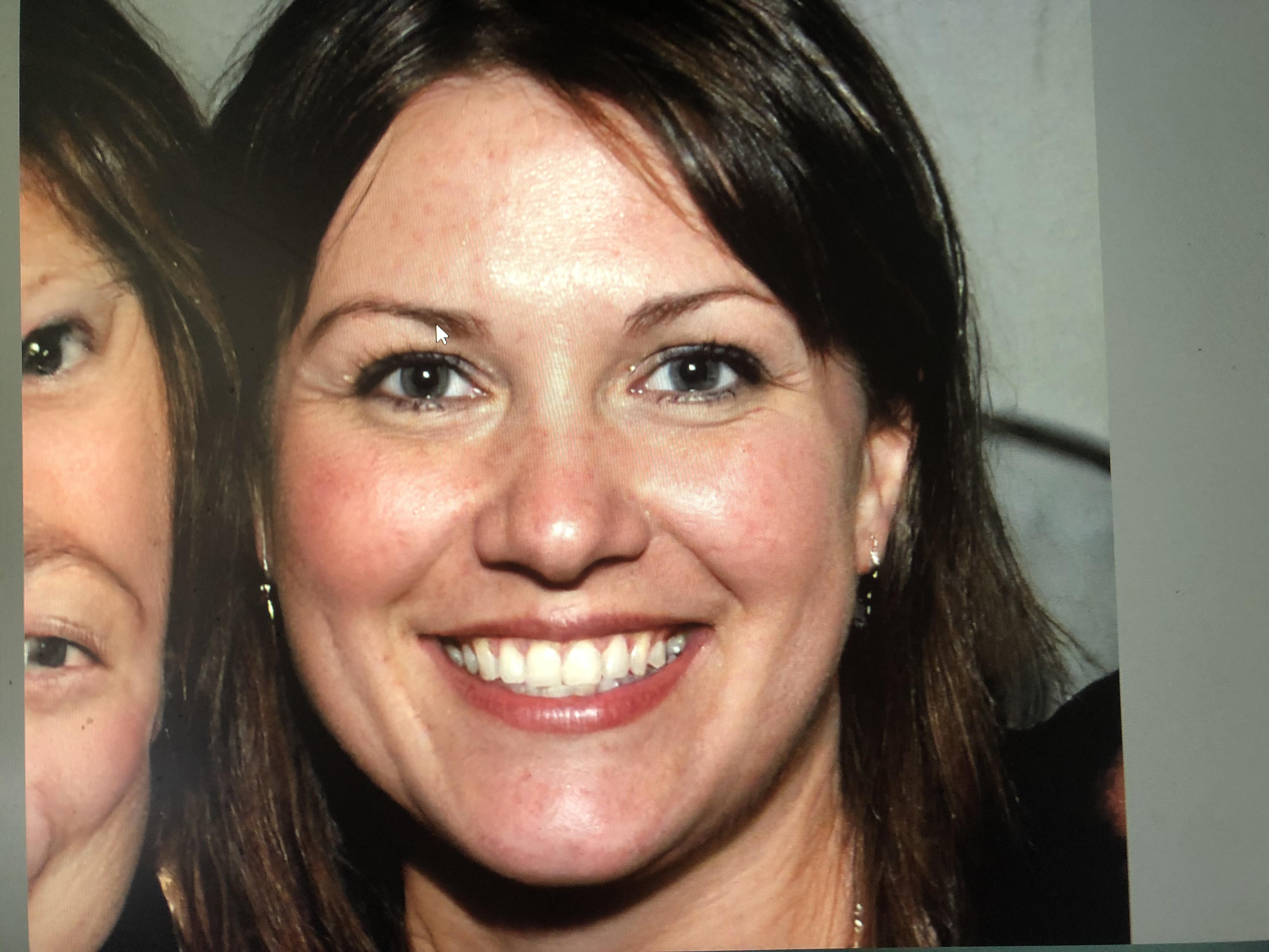 Conjoined | Scrolller