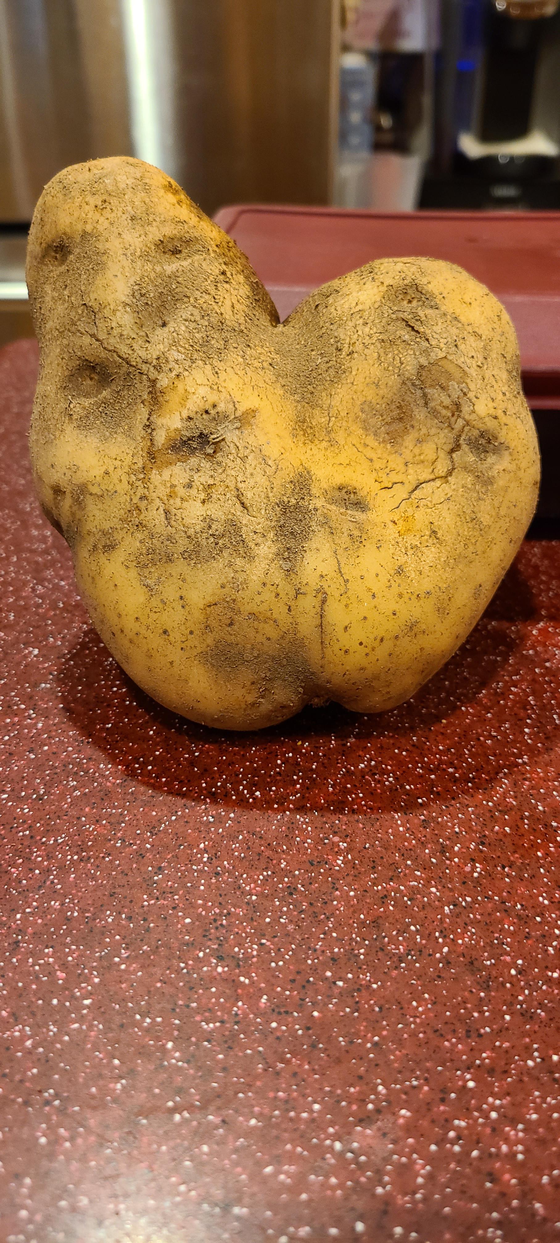 Conjoined twins | Scrolller