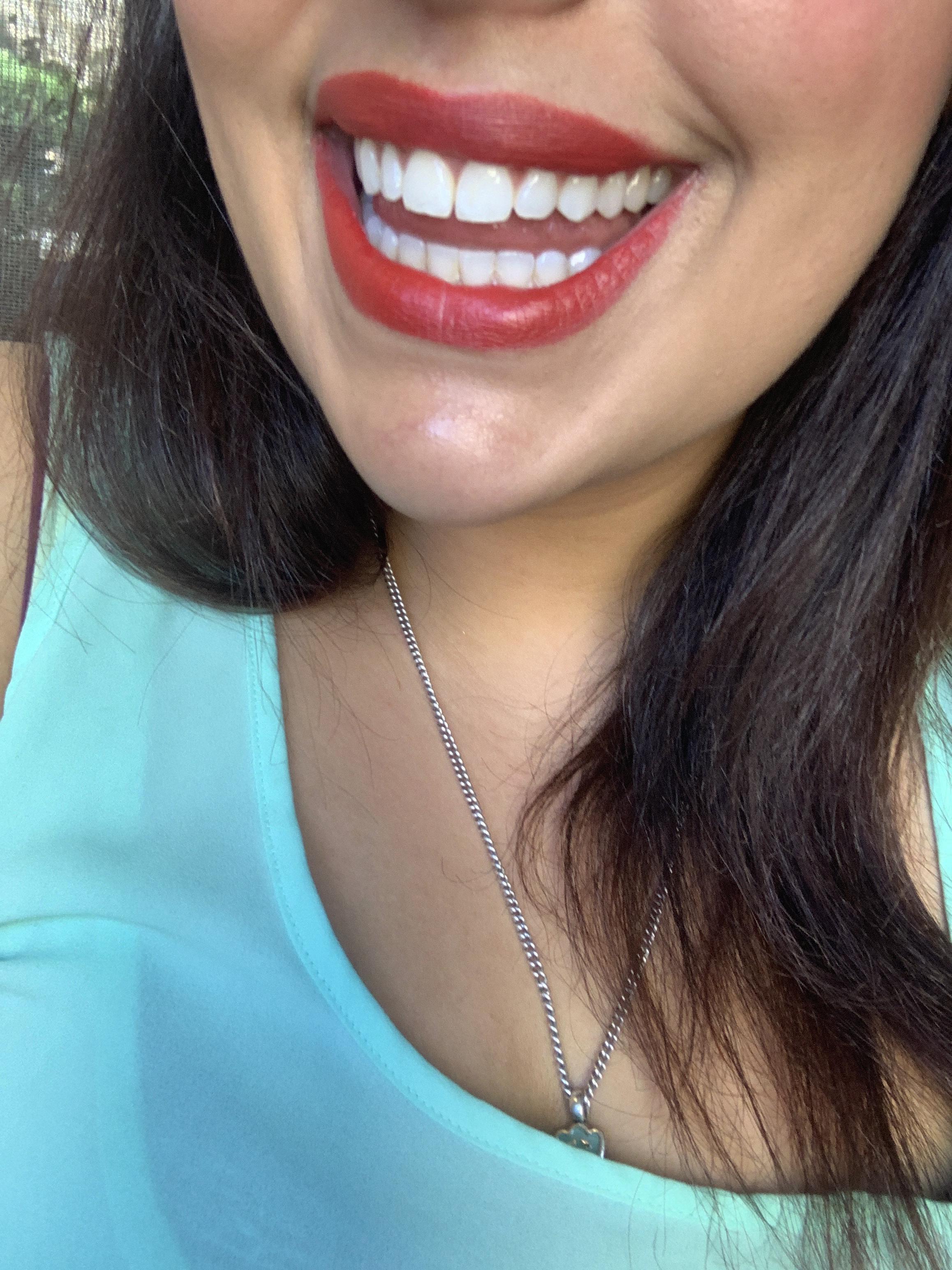 Dental hygiene is so important when living a methy life!! Brush on my friends!! | Scrolller