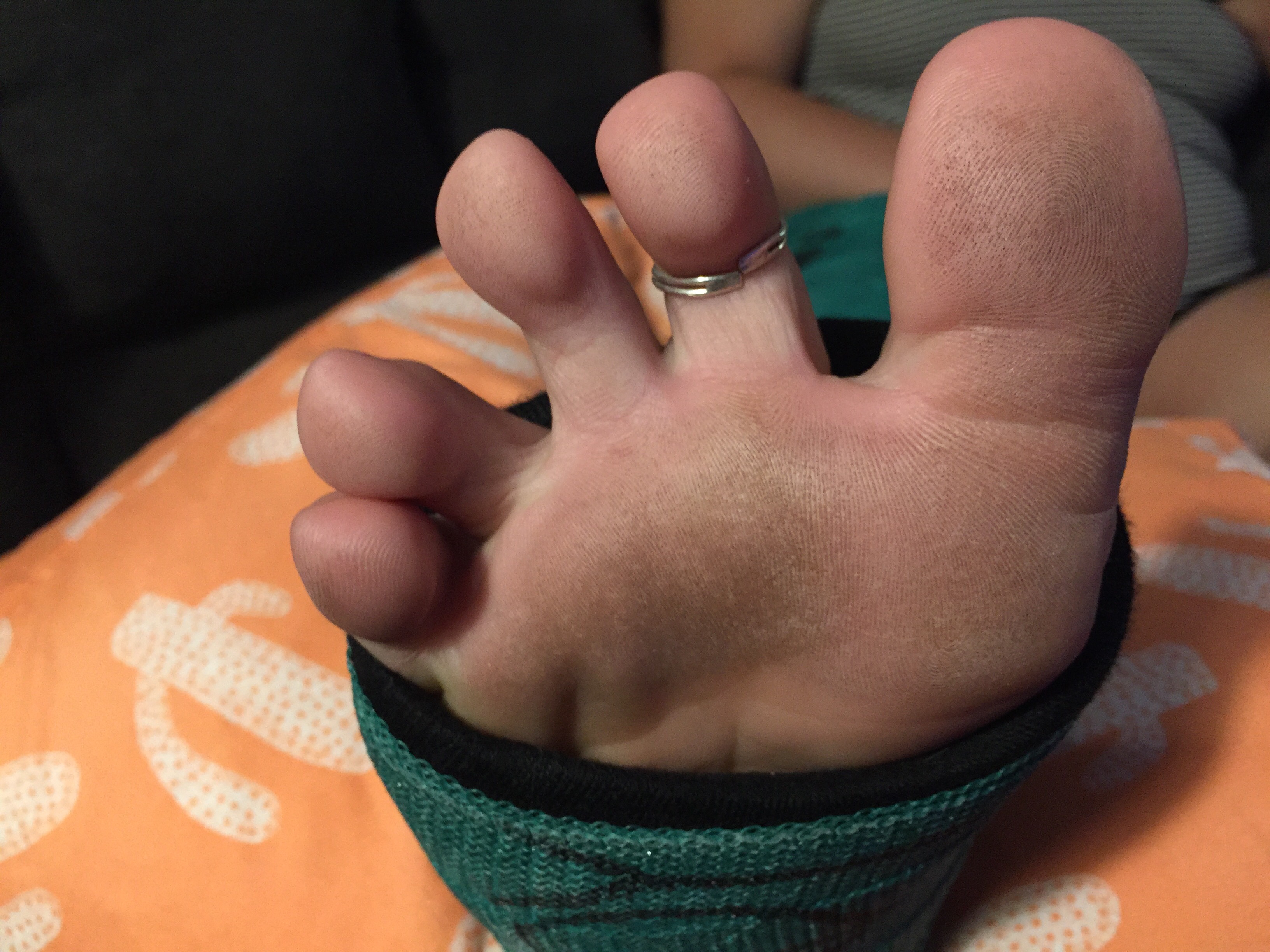 Dirty Casted Toes | Scrolller