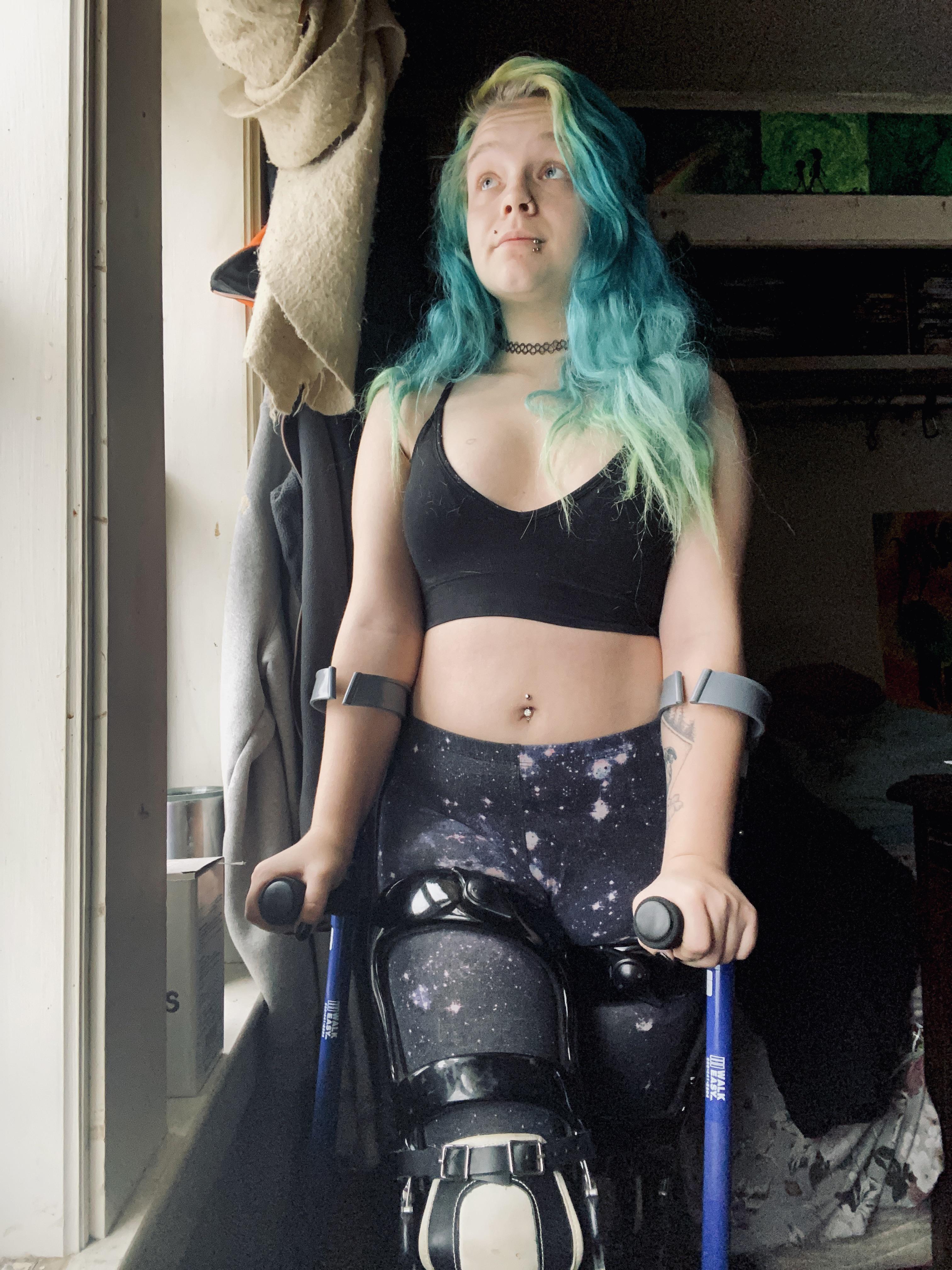 Disabled and still rocking it (: | Scrolller