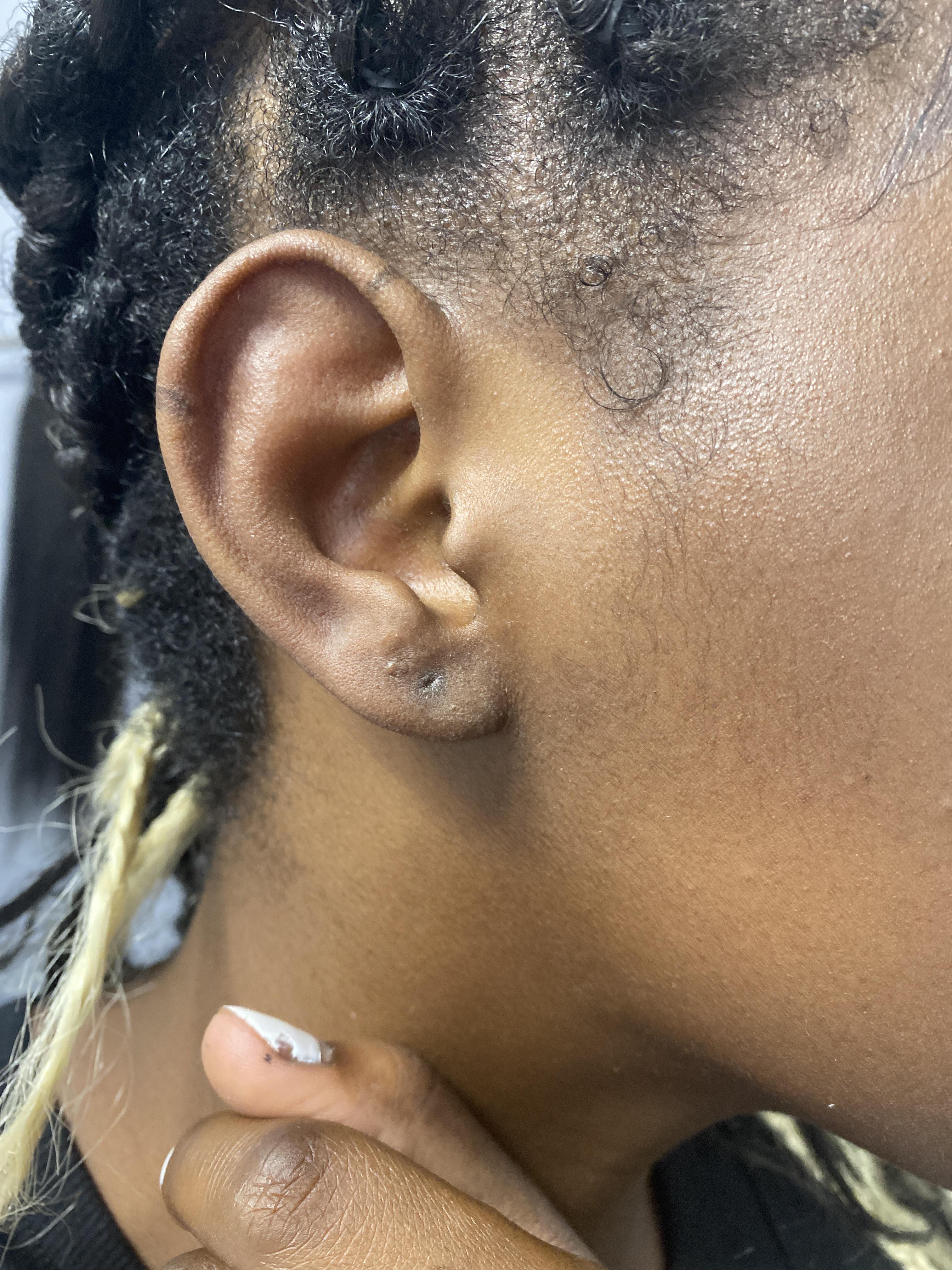 do i have the anatomy for industrial ??please help | Scrolller