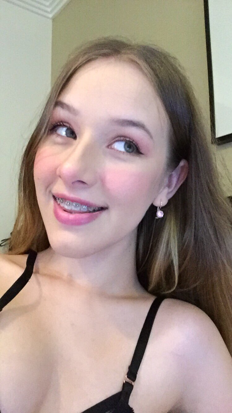 Do you like girls with braces? [23F] | Scrolller