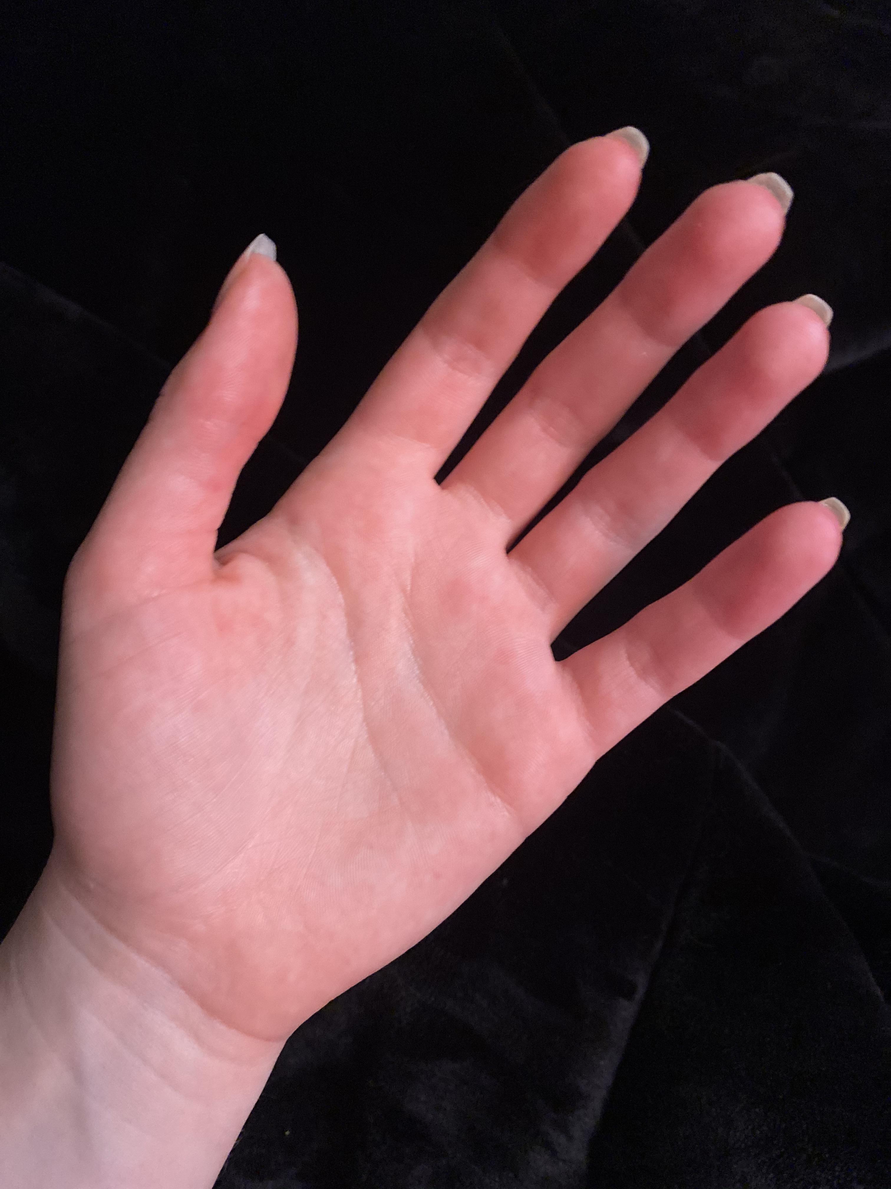 Soft palm :) | Scrolller