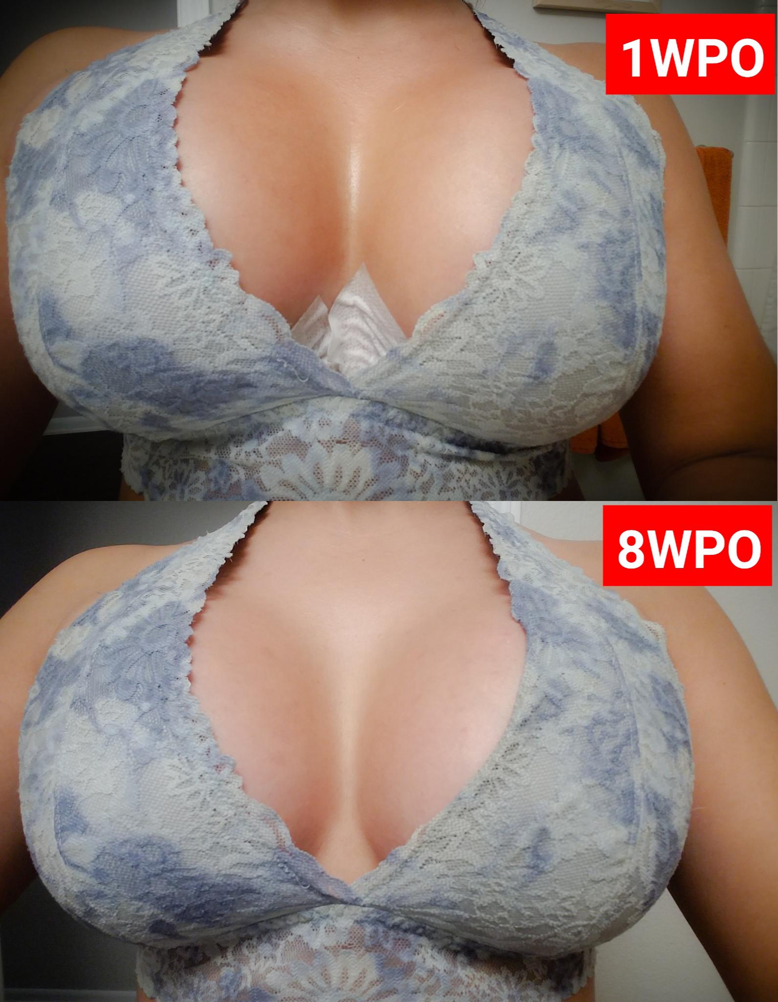 Drop and fluff bolt on update 😘 | Scrolller