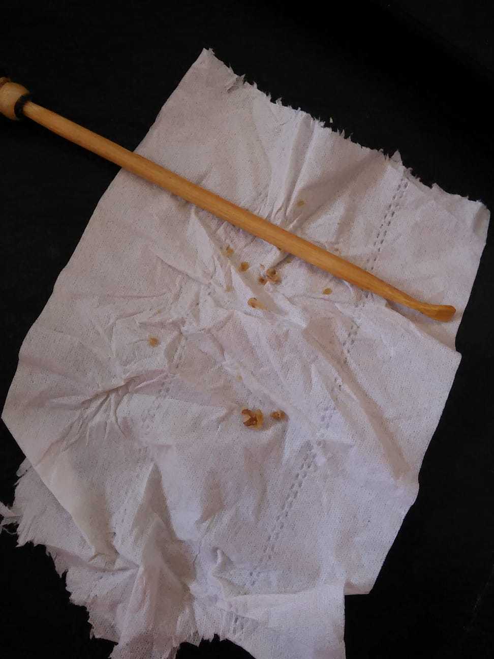 Dry ear wax from both ears after a ear cleaning session a few days ago, alongside the ear pick ...