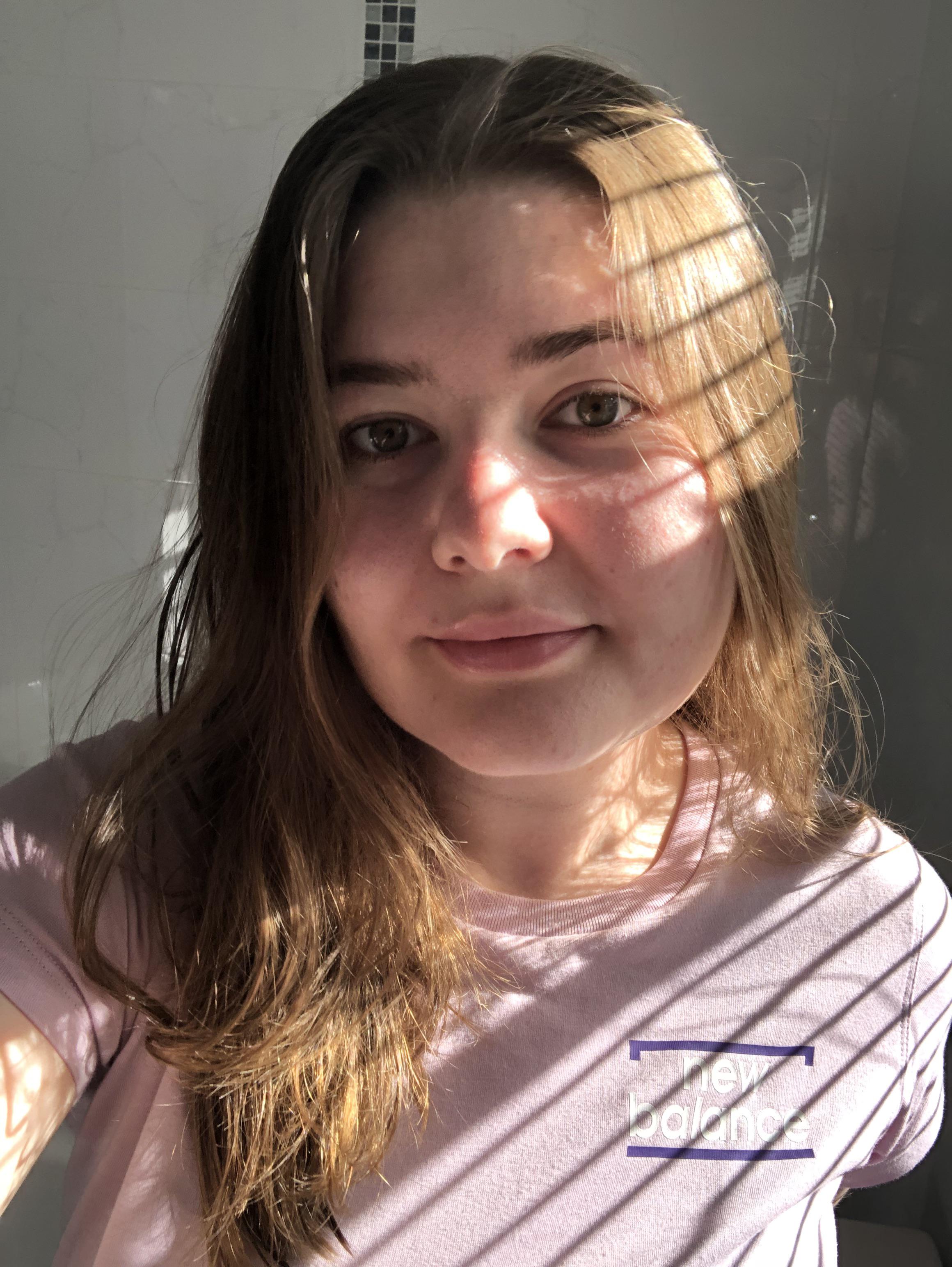 Embracing my natural face | Scrolller